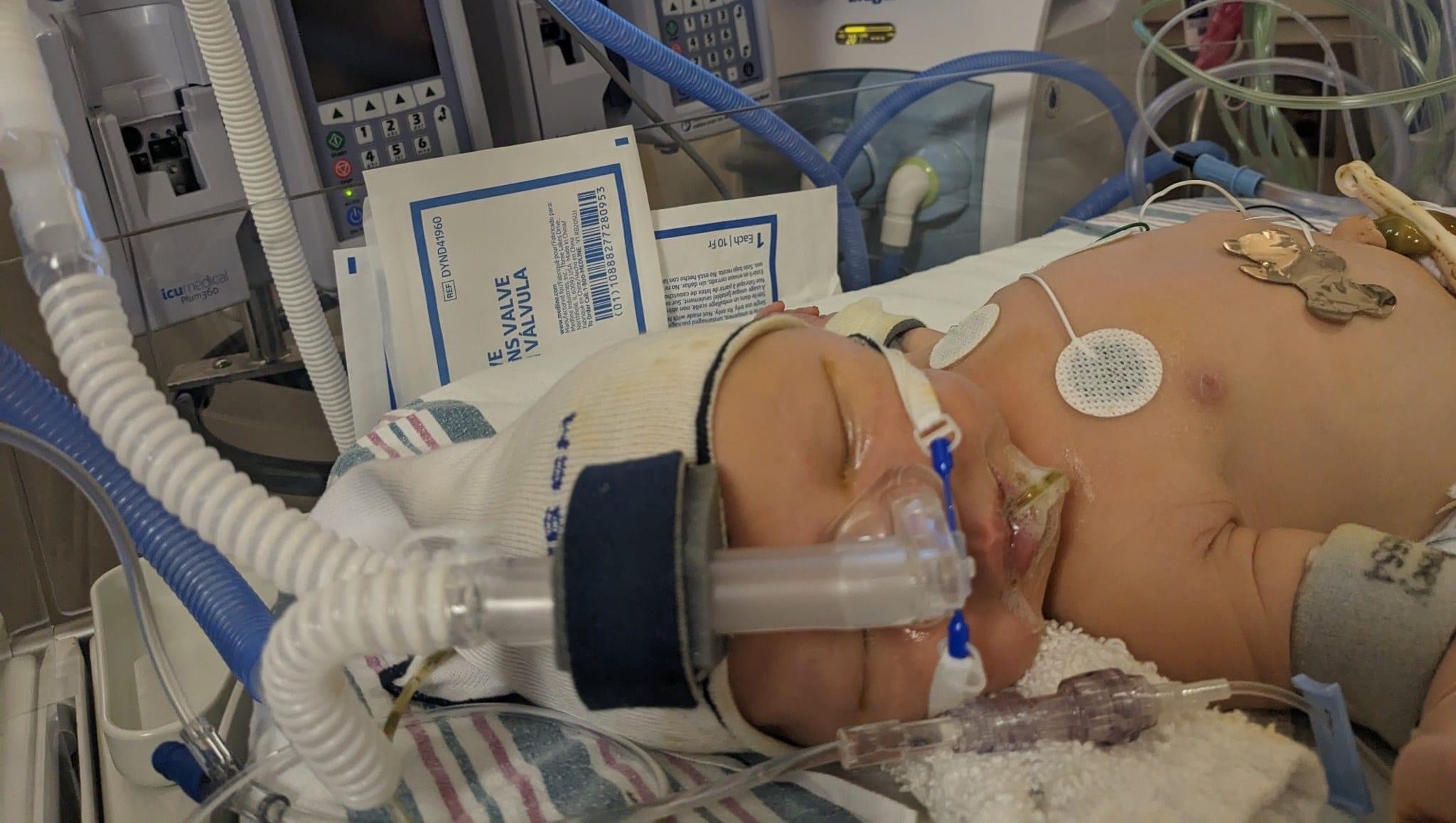 Spendenkampagne von Haley Sakki für Philippe Prevost: Baby Xavier