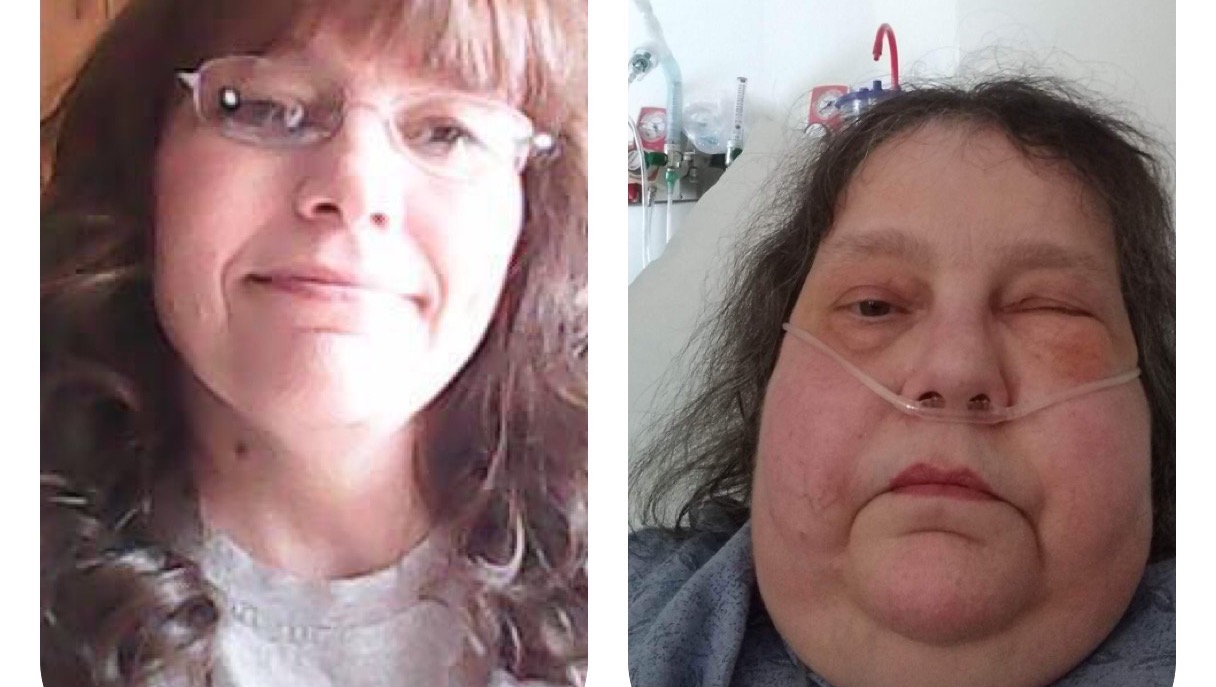 Fundraiser by Kevin Pinette : Costly expenses for Karen Pinette Merriam