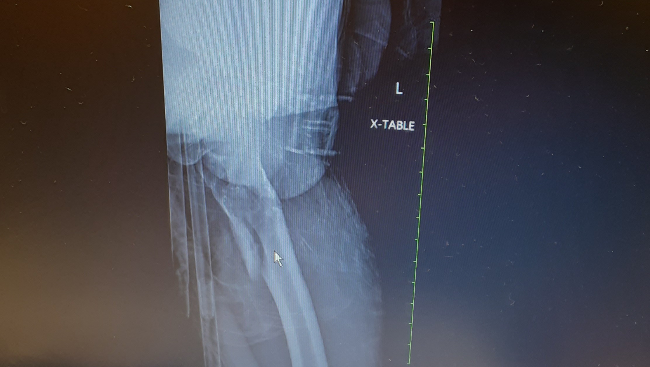 Fundraiser by Josh Matz : Help Josh with his recovery