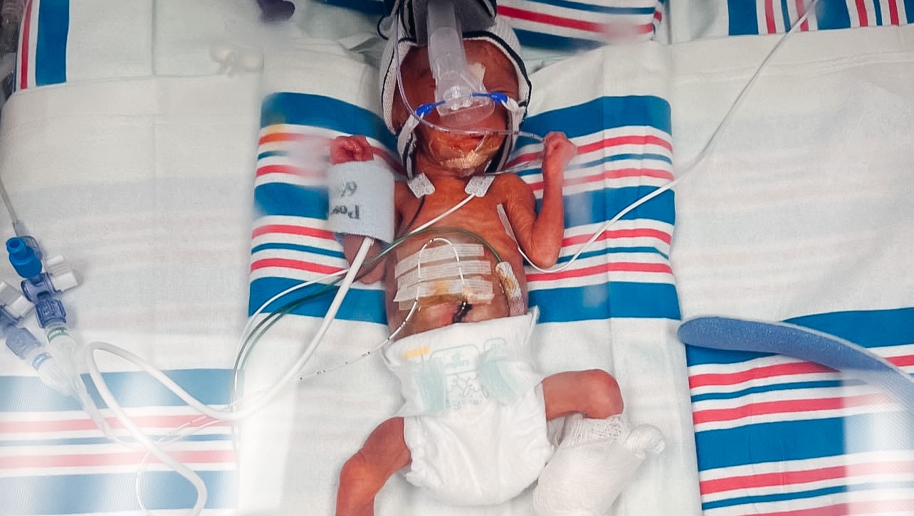 Fundraiser for Sydney Frazier by Brooke Davis : The Frazier Family and ...
