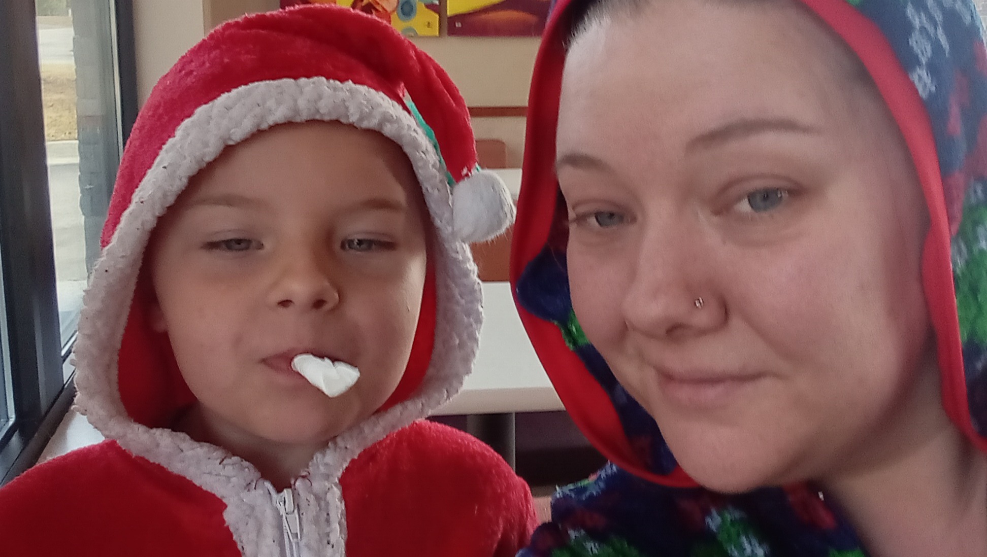 Fundraiser by Summer Wilcox : chiara malformation brain surgery