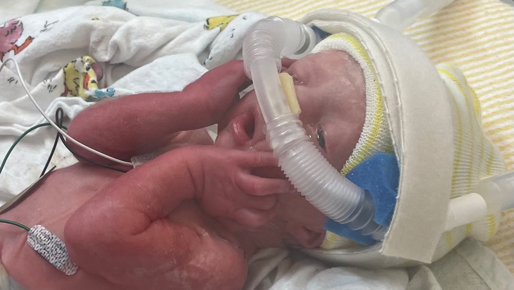 Fundraiser for Lisa Davis by Jill Rathbun : Help Jessie Davis with ...