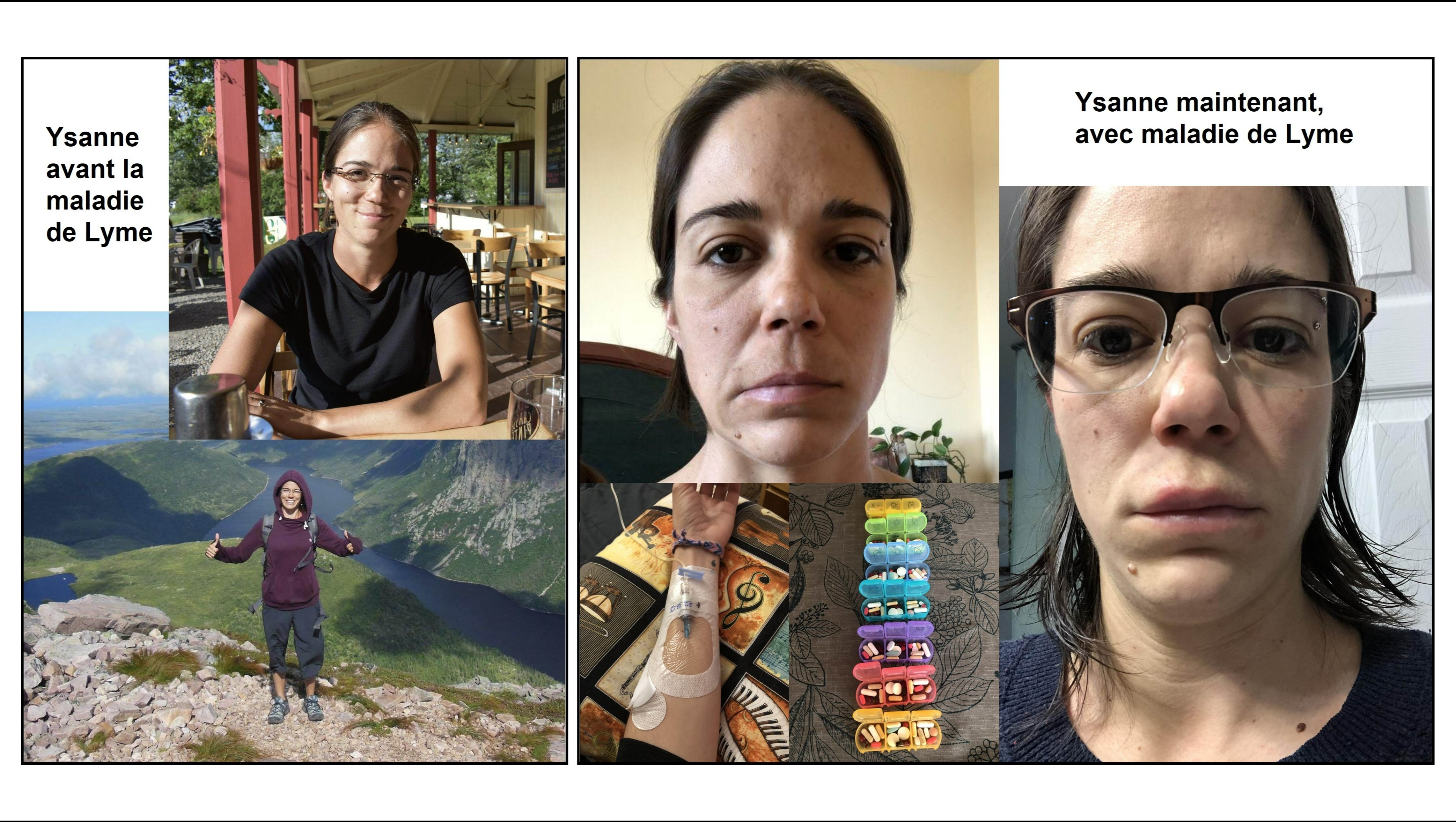 Fundraiser for Ysanne Breton by Karine Grondin : Ensemble, redonnons à ...