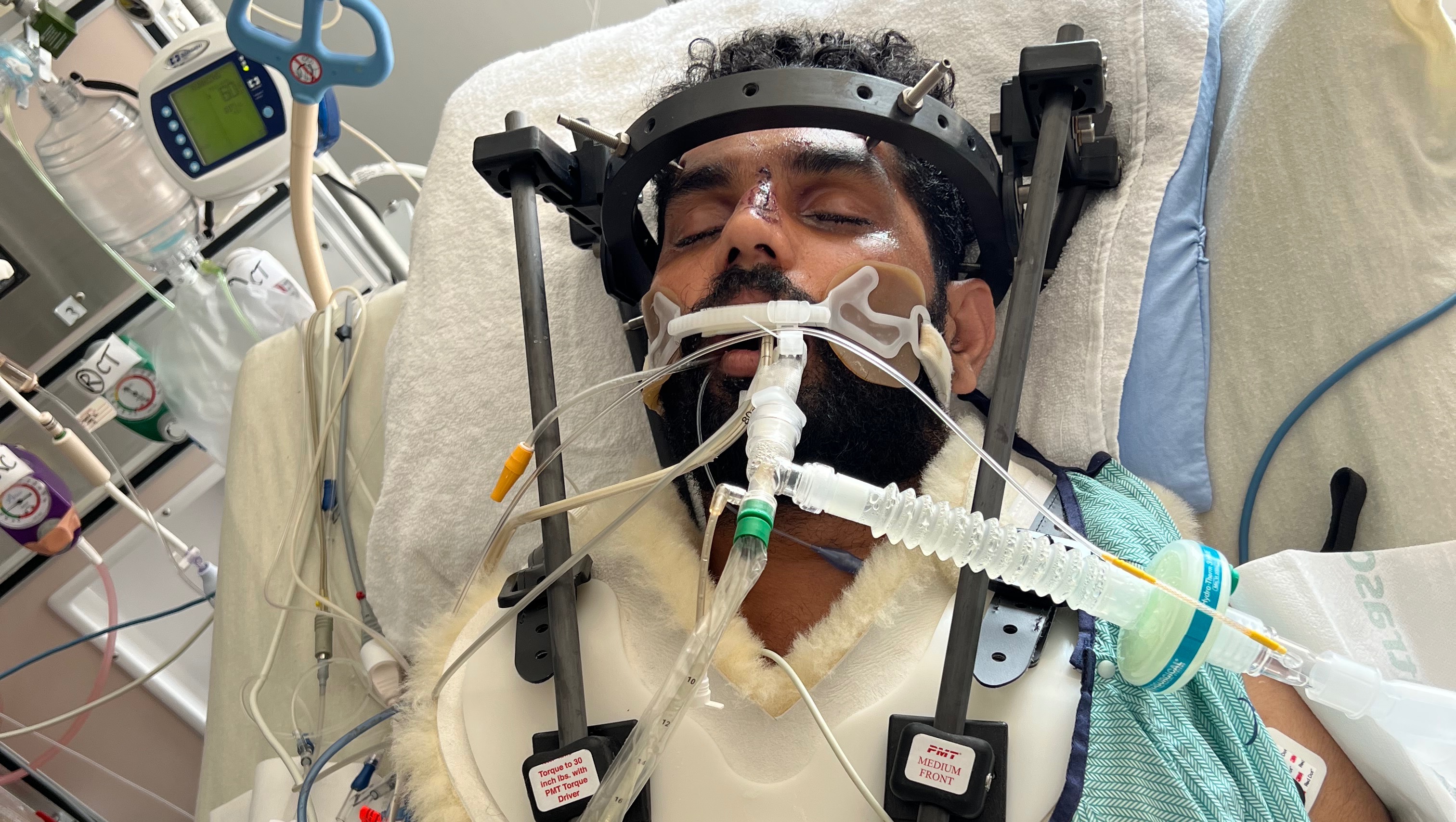 Fundraiser by Satpreet Singh : Help for Vinkal Kumar