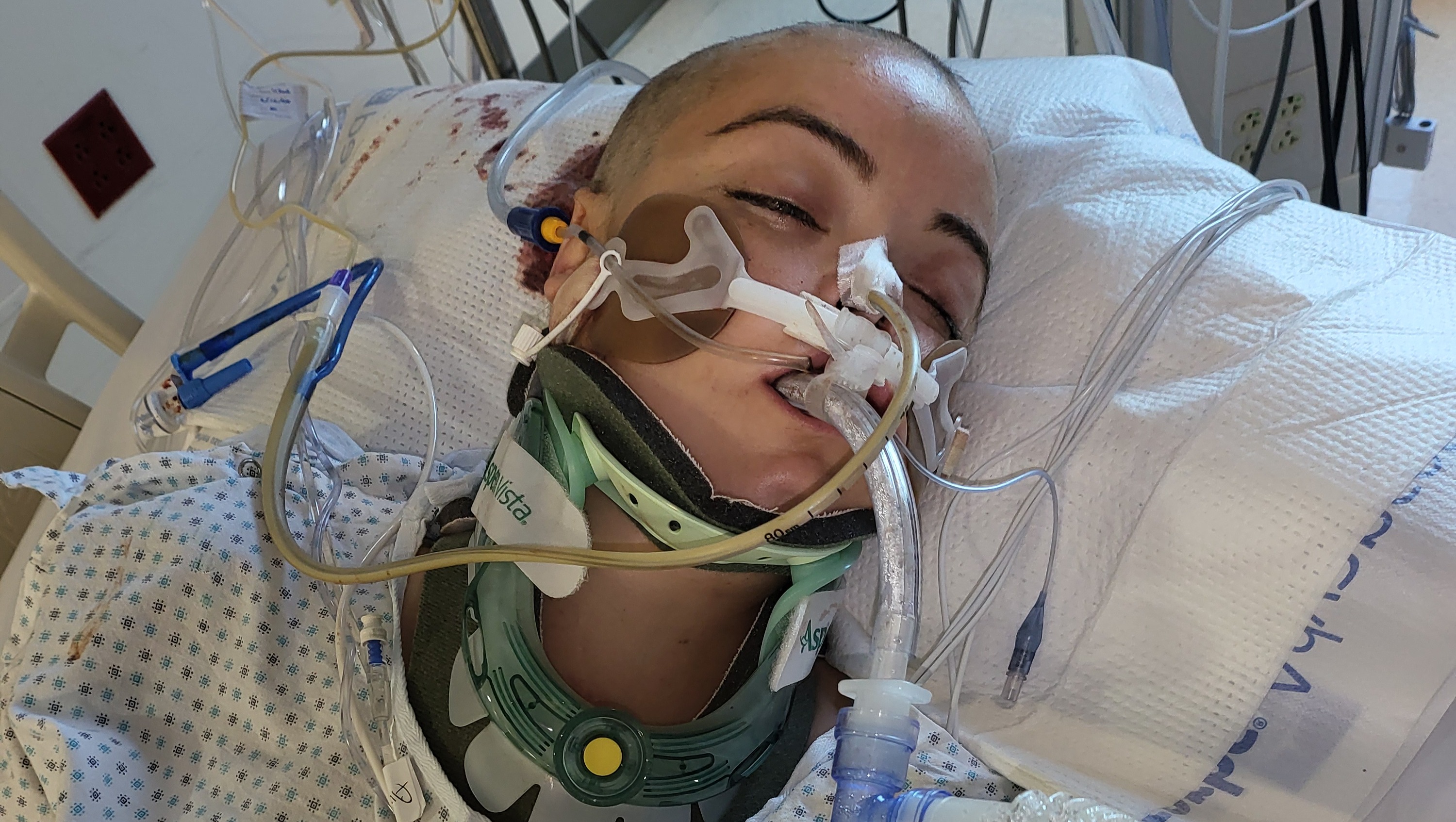 Fundraiser for Charles Cable by Rachael Herd : Britinie is in the ICU