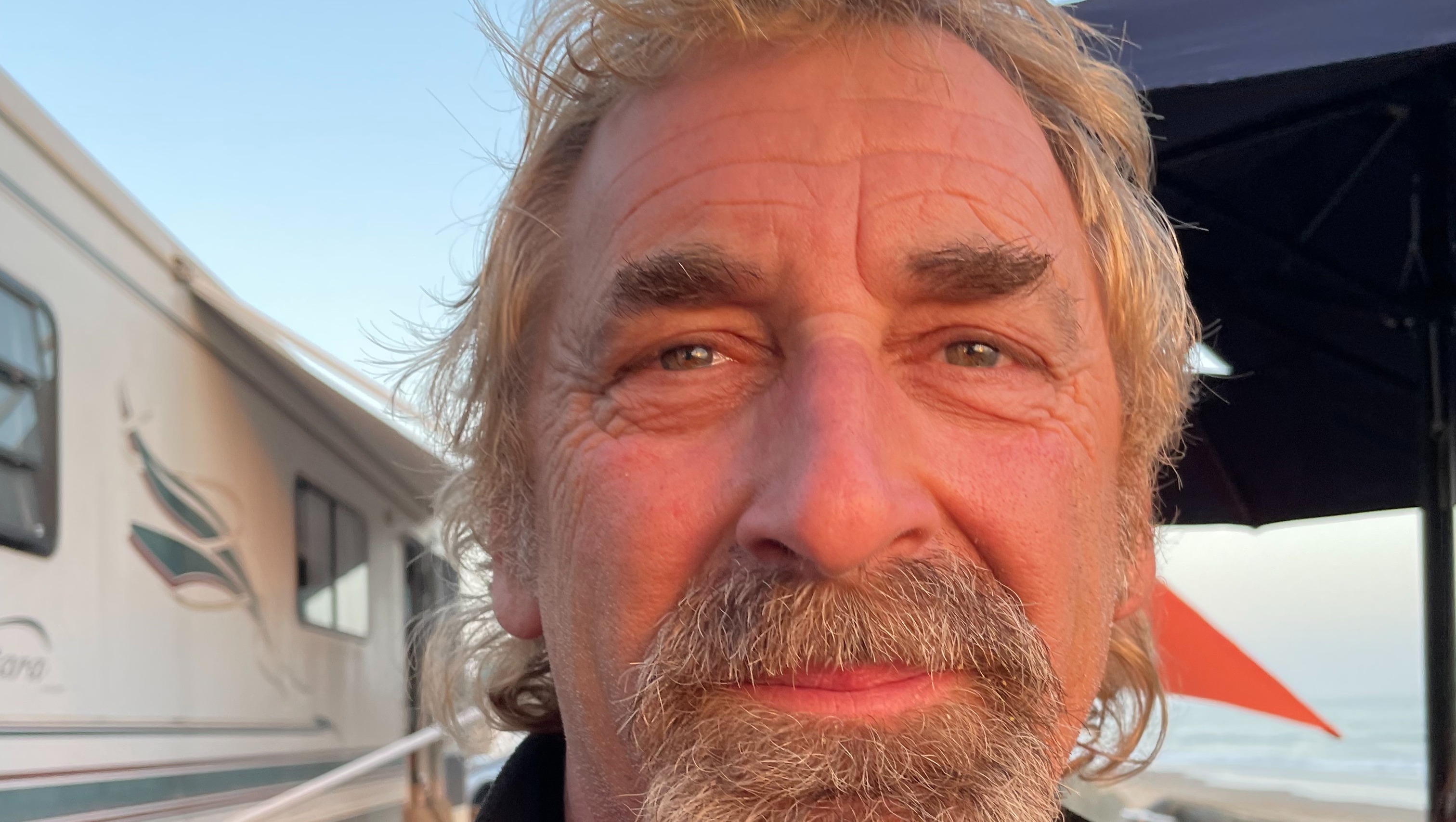 Fundraiser for Todd Hannigan by Todd Hannigan : Lane's open heart ...