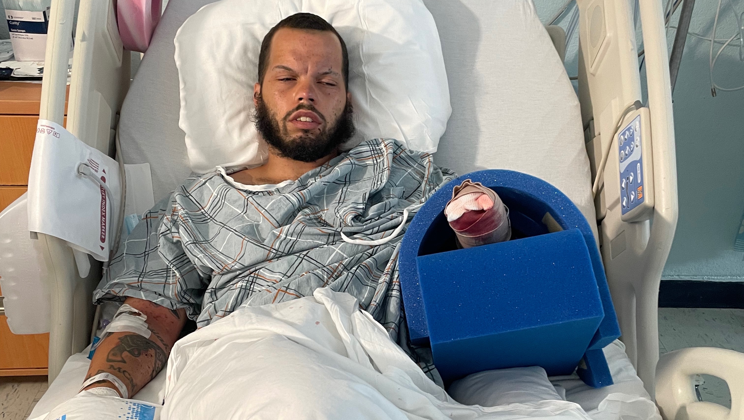 Fundraiser by ALIZE DELGADO : Getting Jason a prosthetic hand
