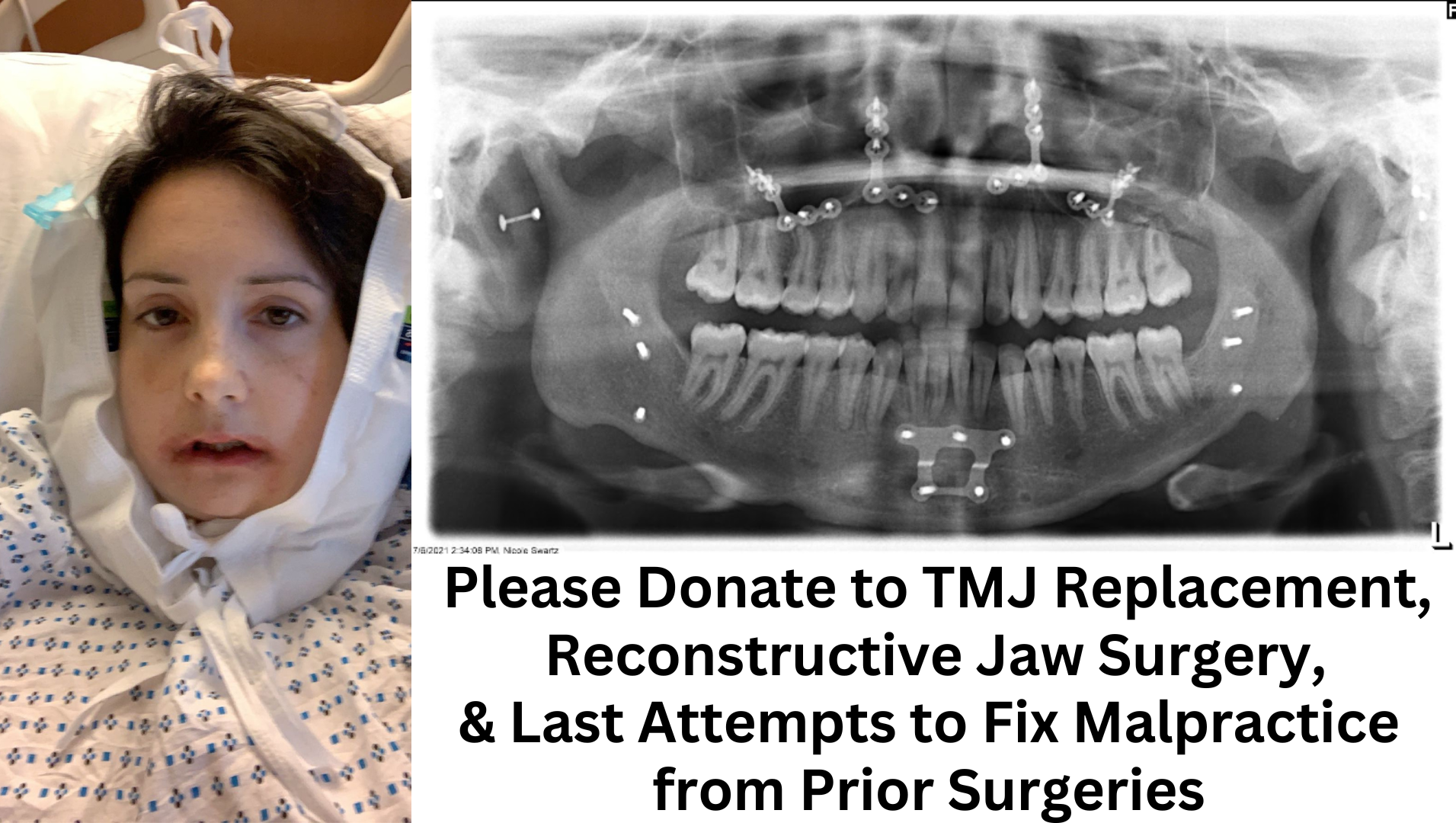 Fundraiser by Nikki Swartz : Help w. Jaw and TMJ Surgery After Malpractice