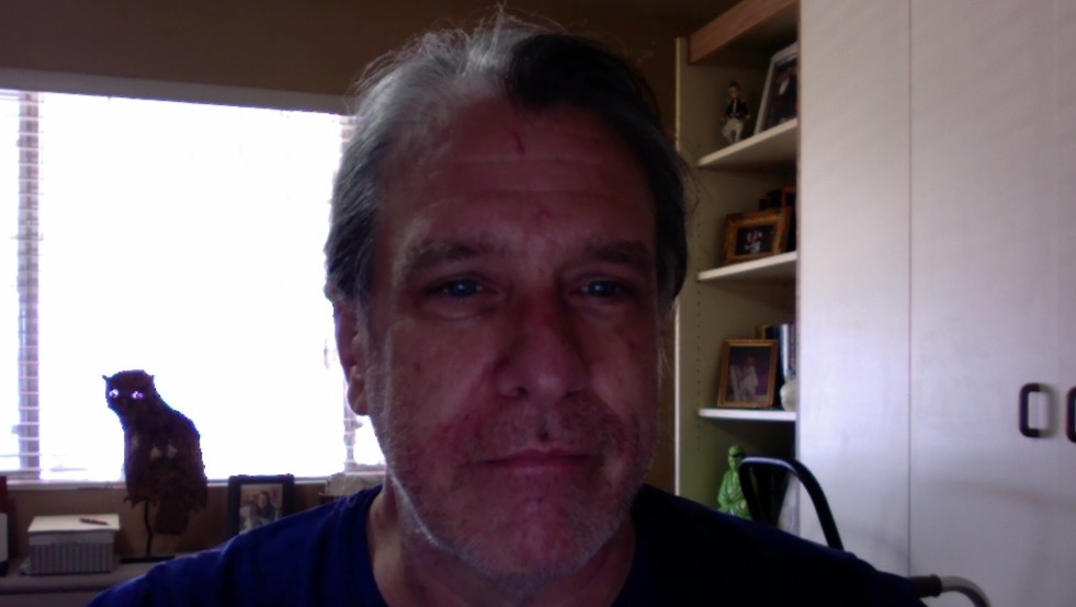 Fundraiser by Frederick Robinson : Medical Costs