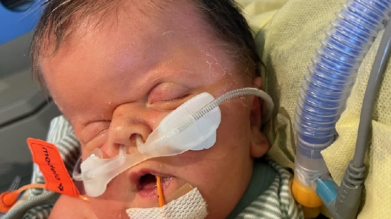 Fundraiser for Rachel Klees by Sherry Haun : Baby Elwyn's medical bills ...