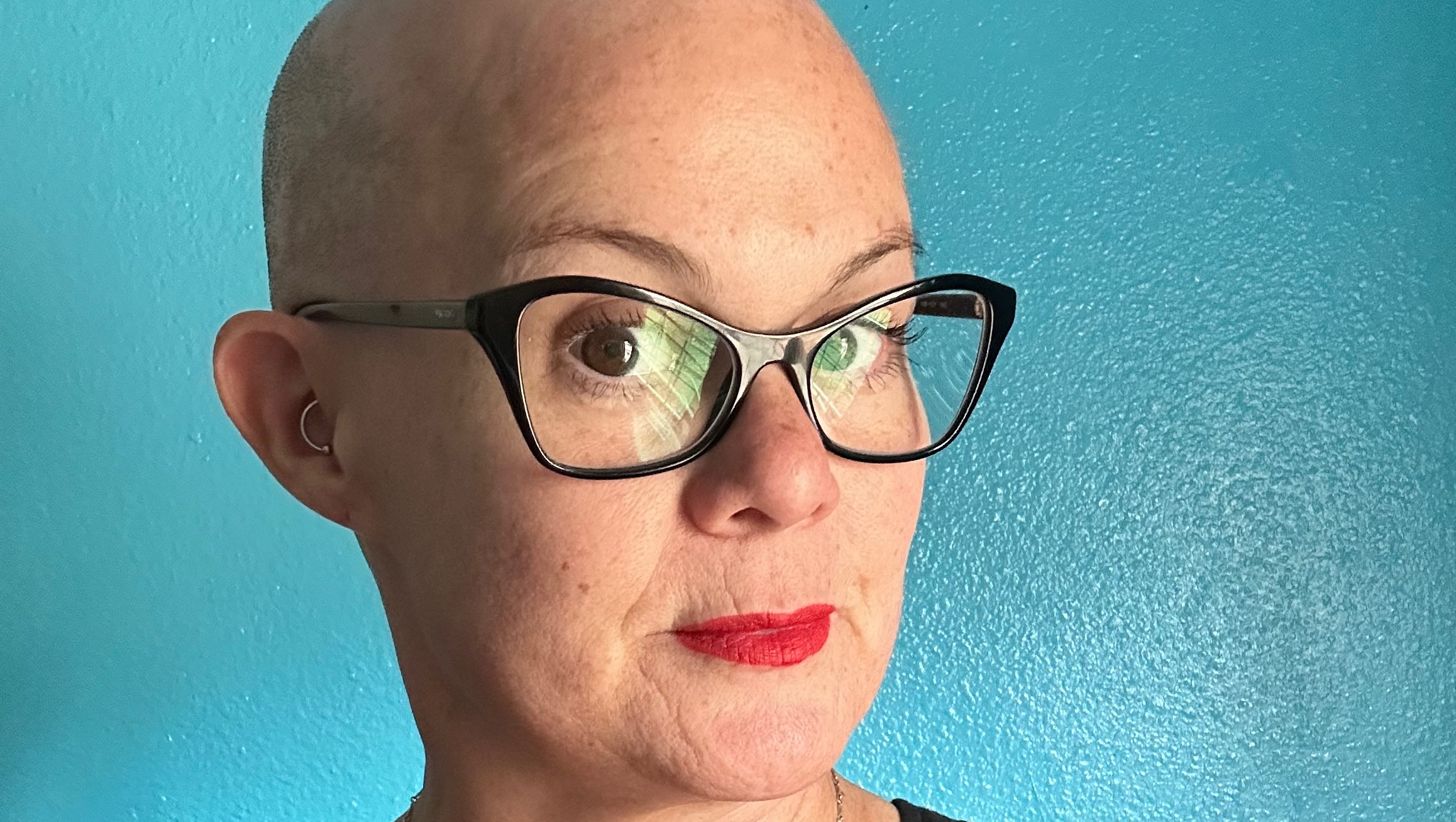 Fundraiser for Tonia Hume by Dana Mitchell : Bring Hope by Helping ...