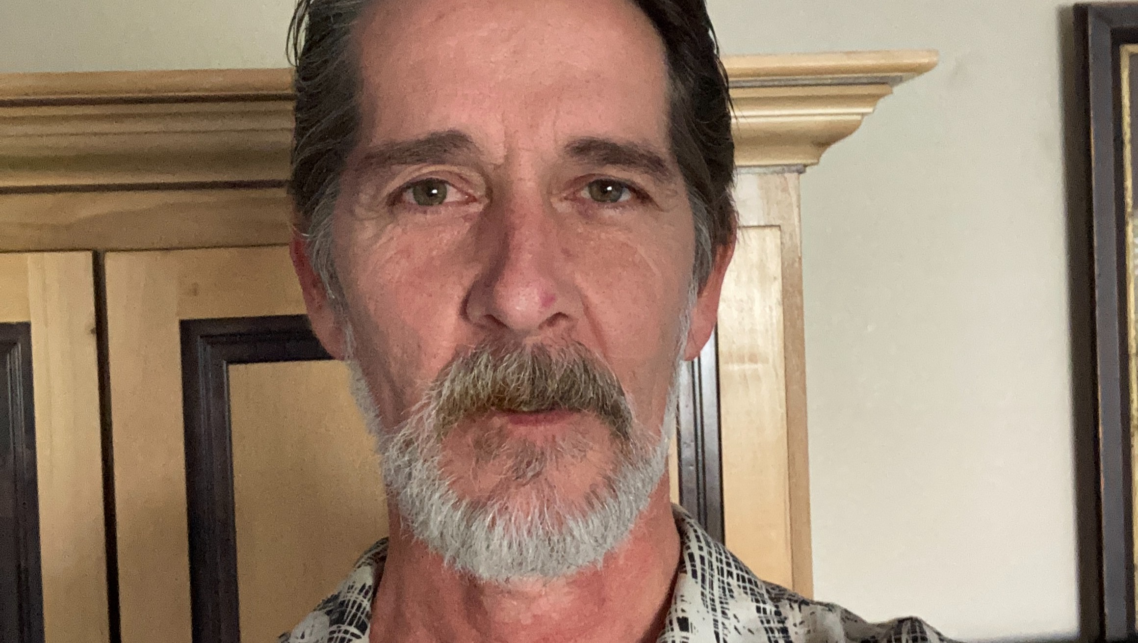 Fundraiser by Damon Lyons : Covid Brain Injury