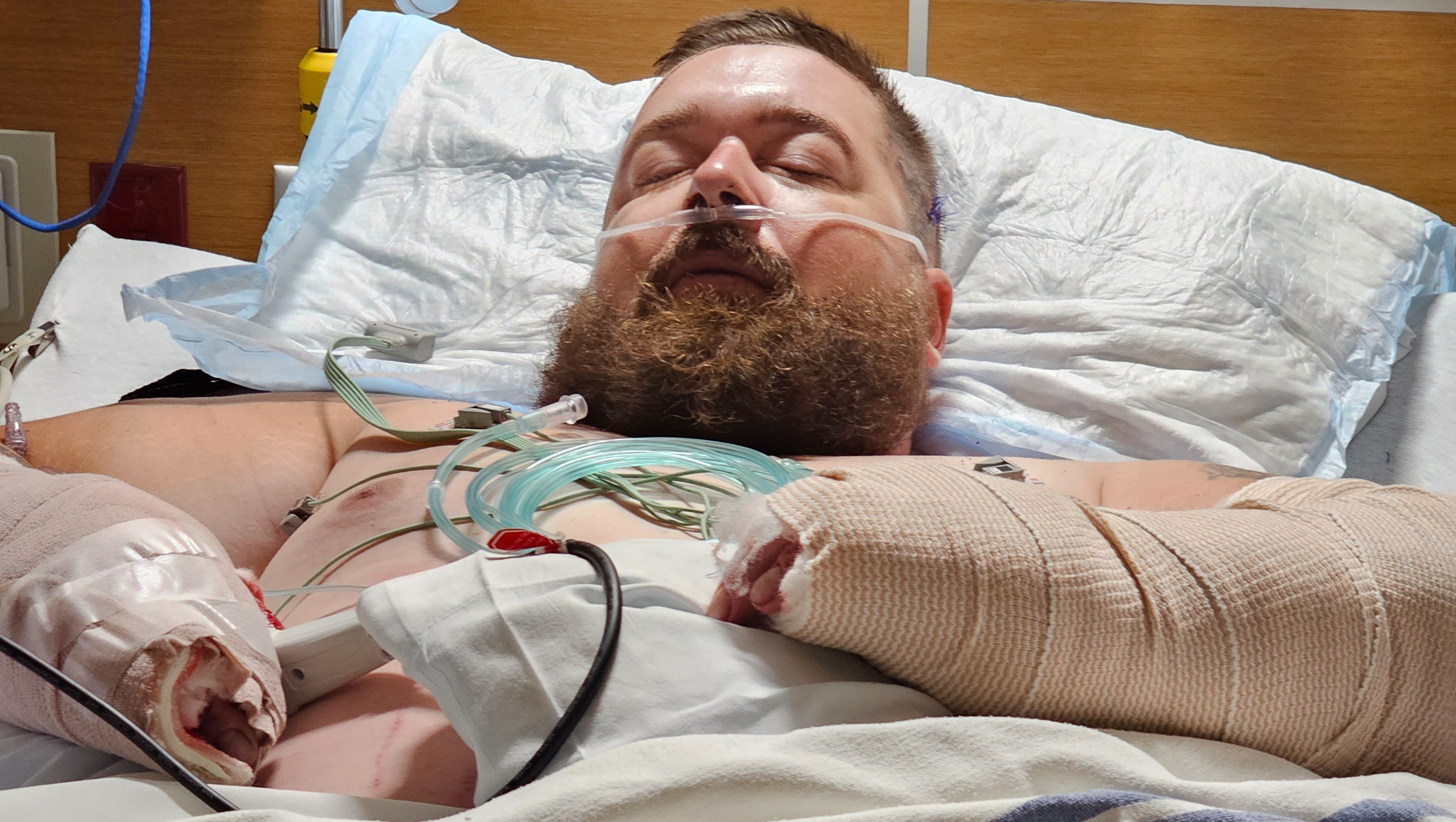Fundraiser by Abbey Fink : Scott (Tarzan) was in a motorcycle accident