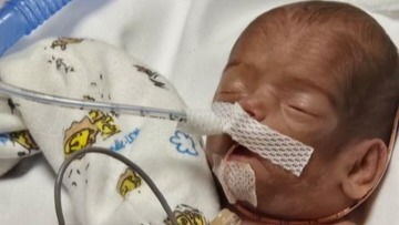 Fundraiser for Nathaniel Linn by Brian Flynn : Baby Linn Medical ...