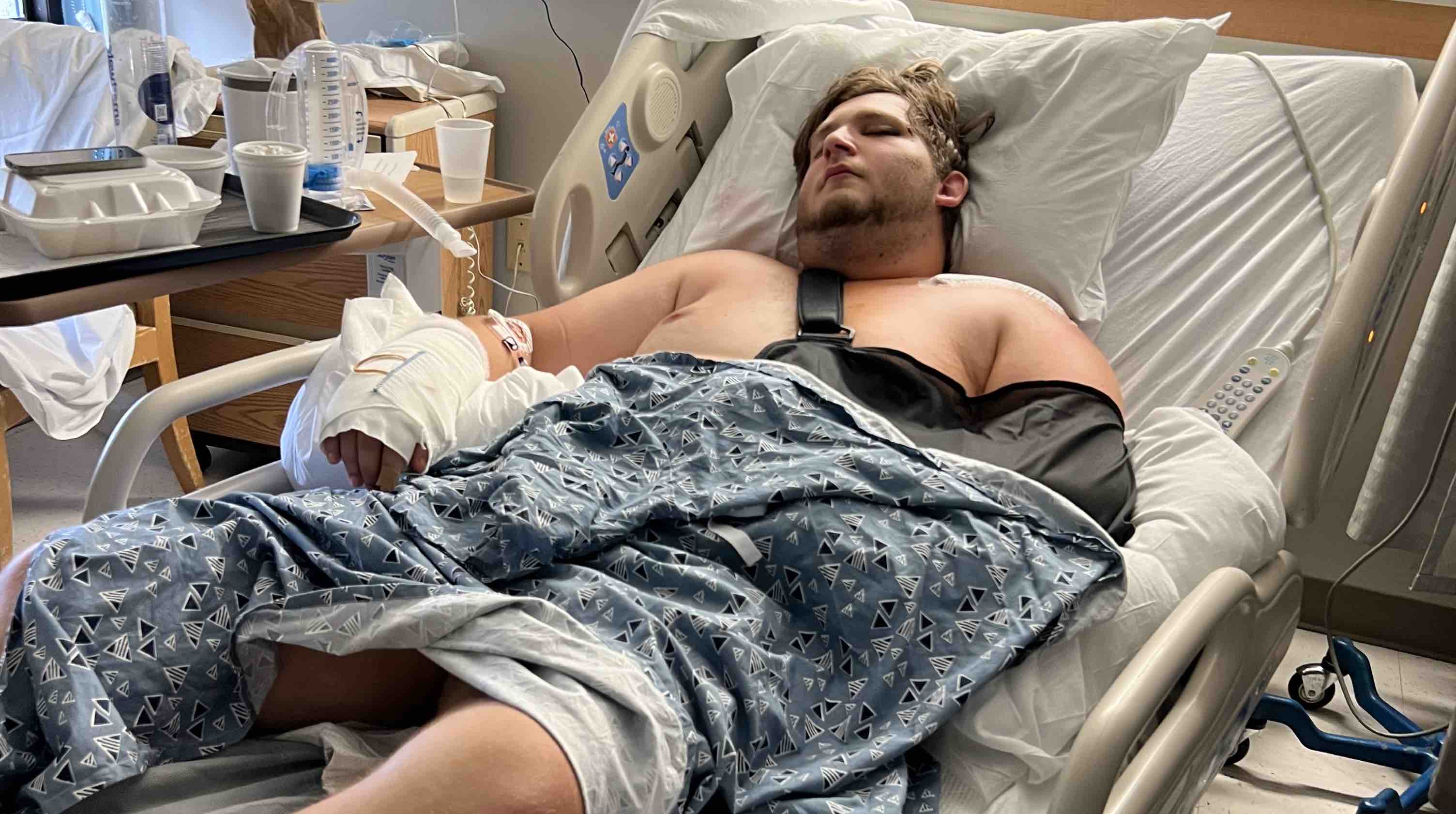 Fundraiser by Blake Varga : Emergency moped accident