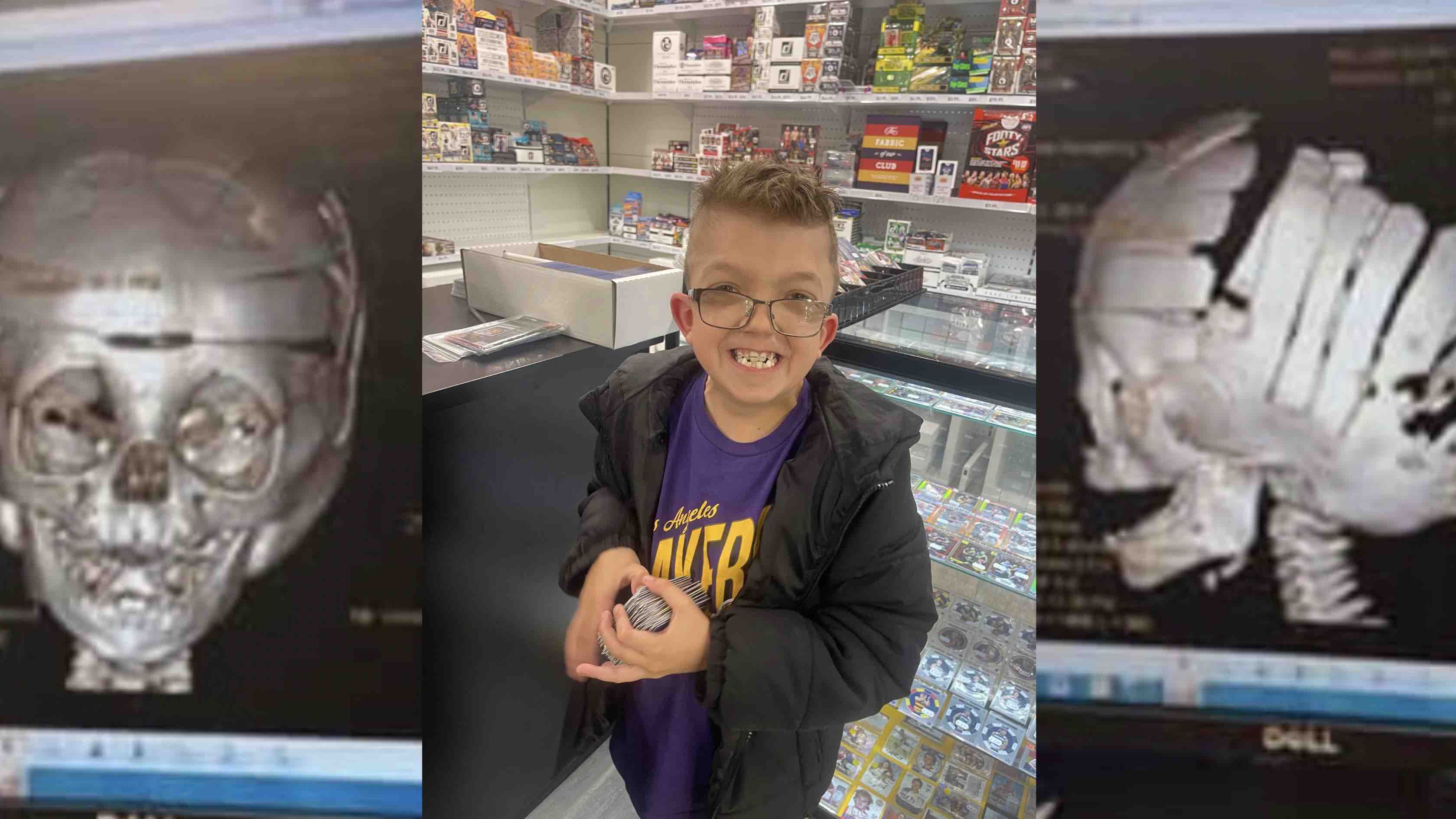 Fundraiser for Bree Hallam by Lauren Graham : Noah’s Brain Surgery