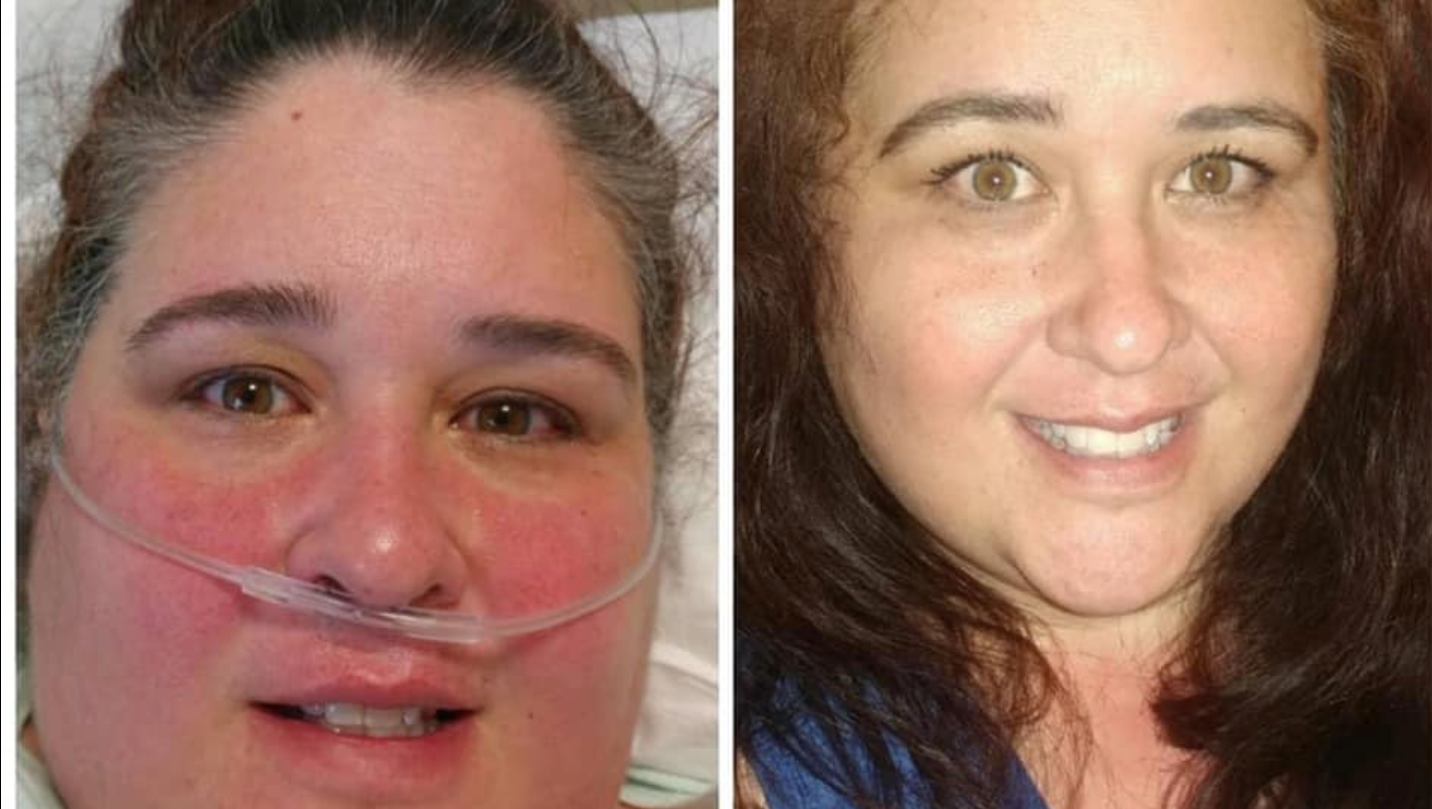 Fundraiser for RACHEL MILSTEAD by Denise Wilkins : Help Rachel "Breathe ...