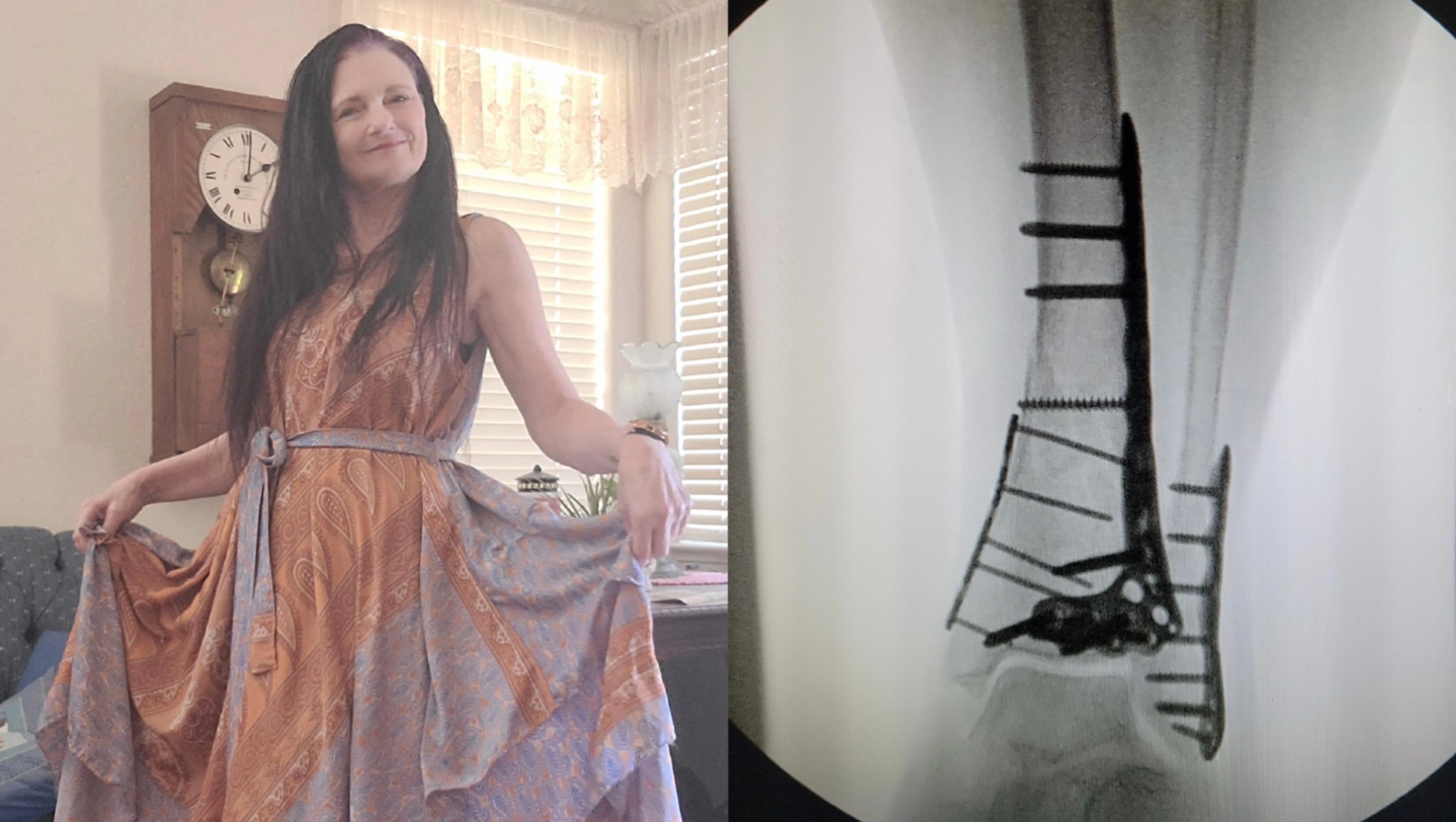 Fundraiser for Sage Simon by Caleb Ingram : Caregiving & Medical for Sage