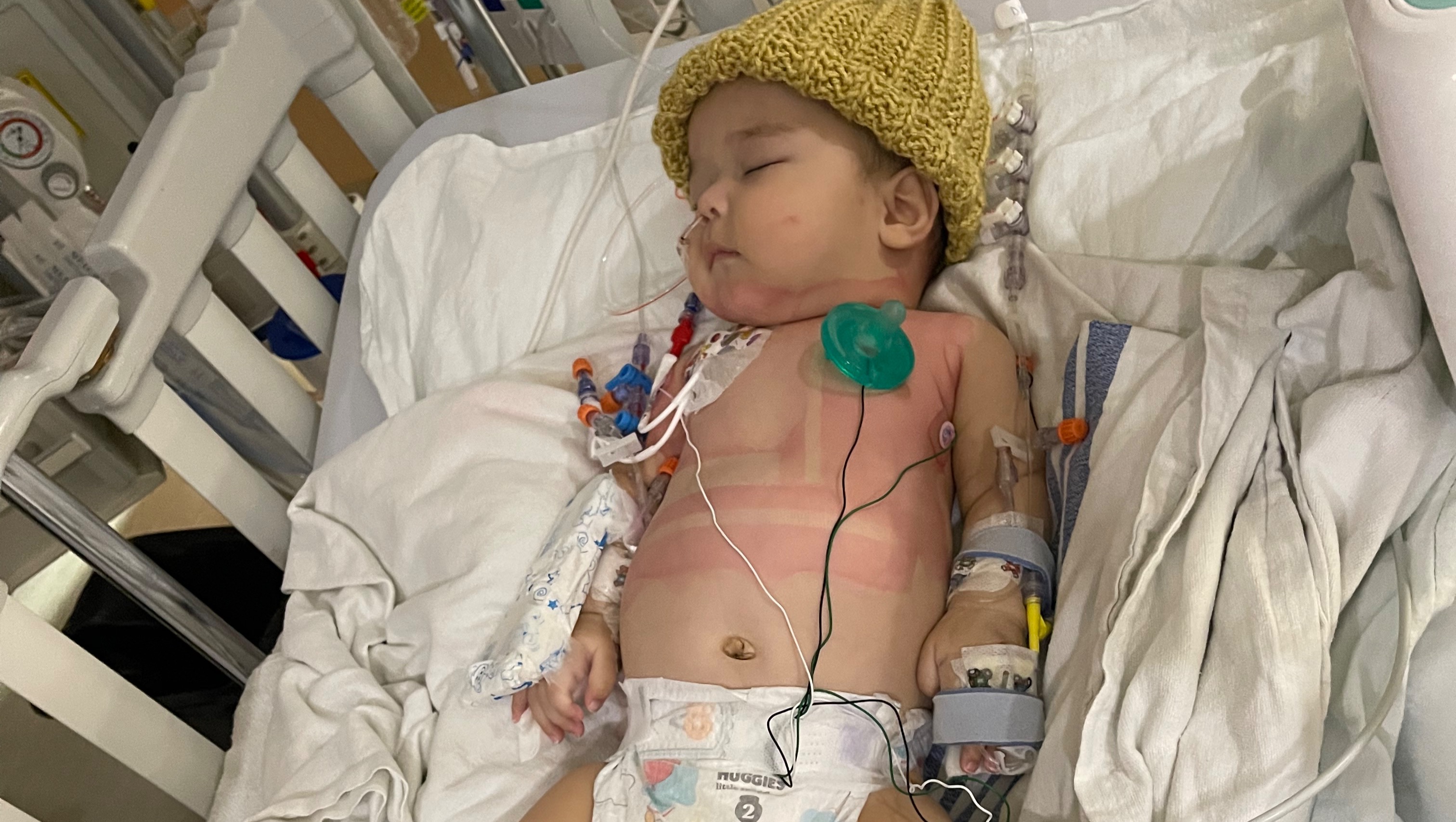 Fundraiser by Brittany Rousseau : Help little Bennett beat Leukemia!