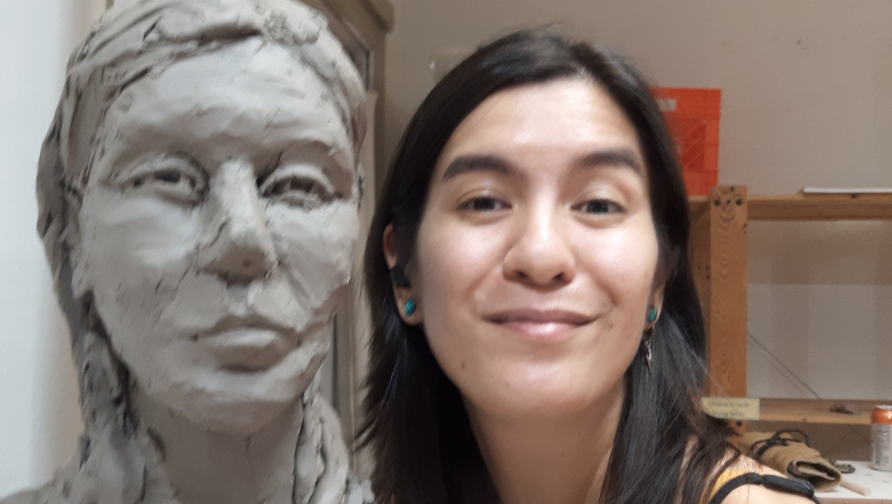 Fundraiser by Laura Nelsen : Support for Dental surgery costs