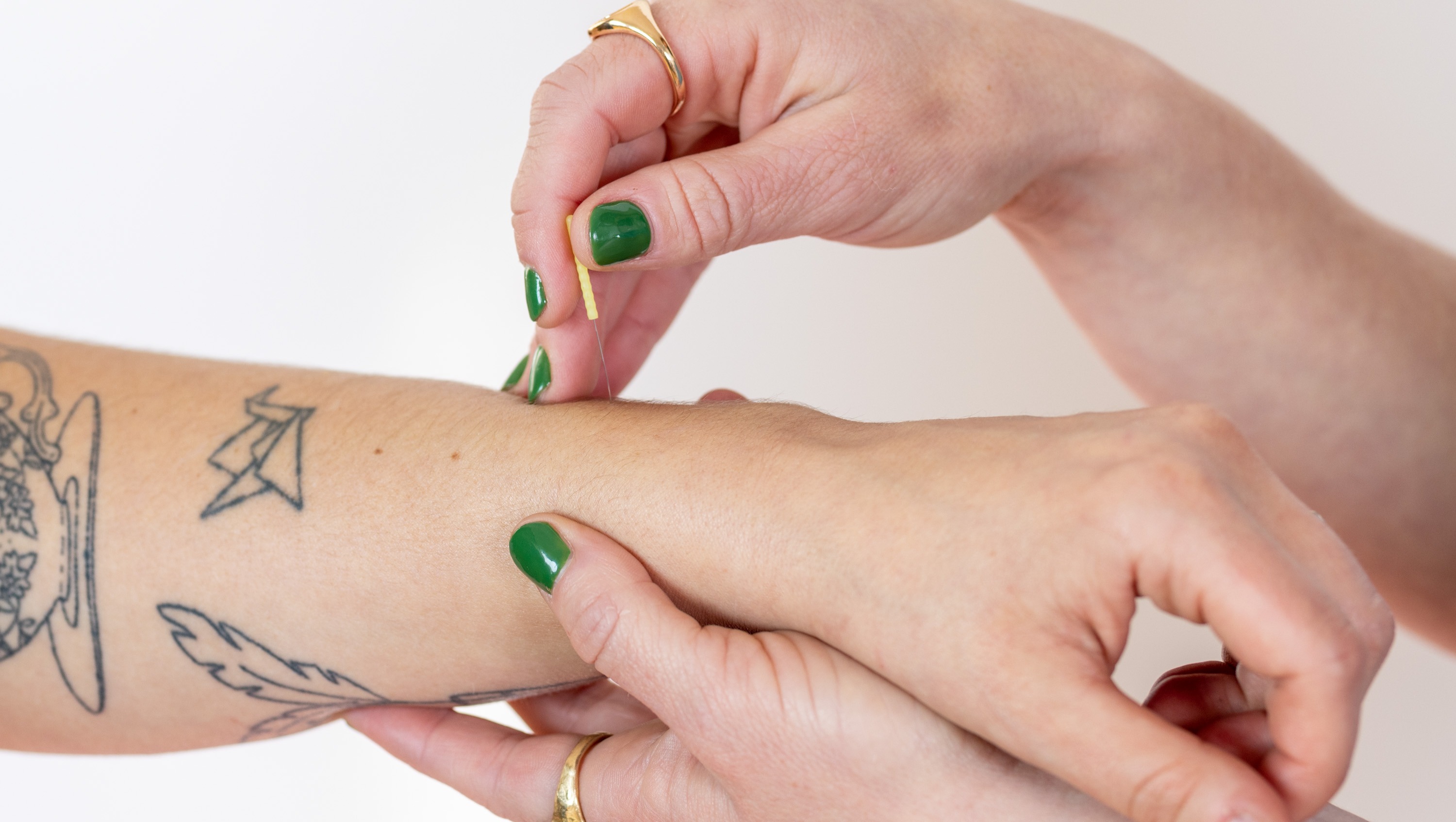 Fundraiser by Tatum Fjerstad : Help Tatum Start Her Acupuncture Practice