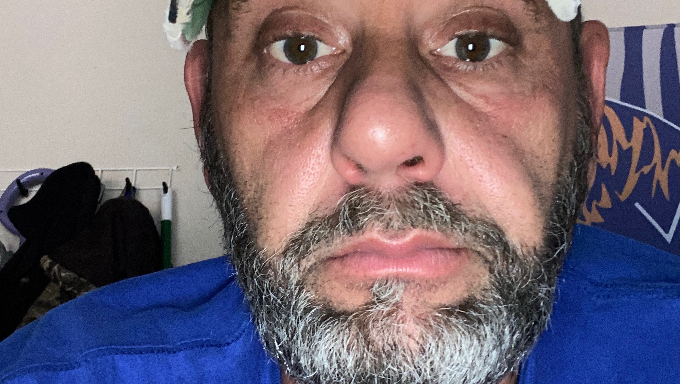 Fundraiser by James Riggs : Brain surgery