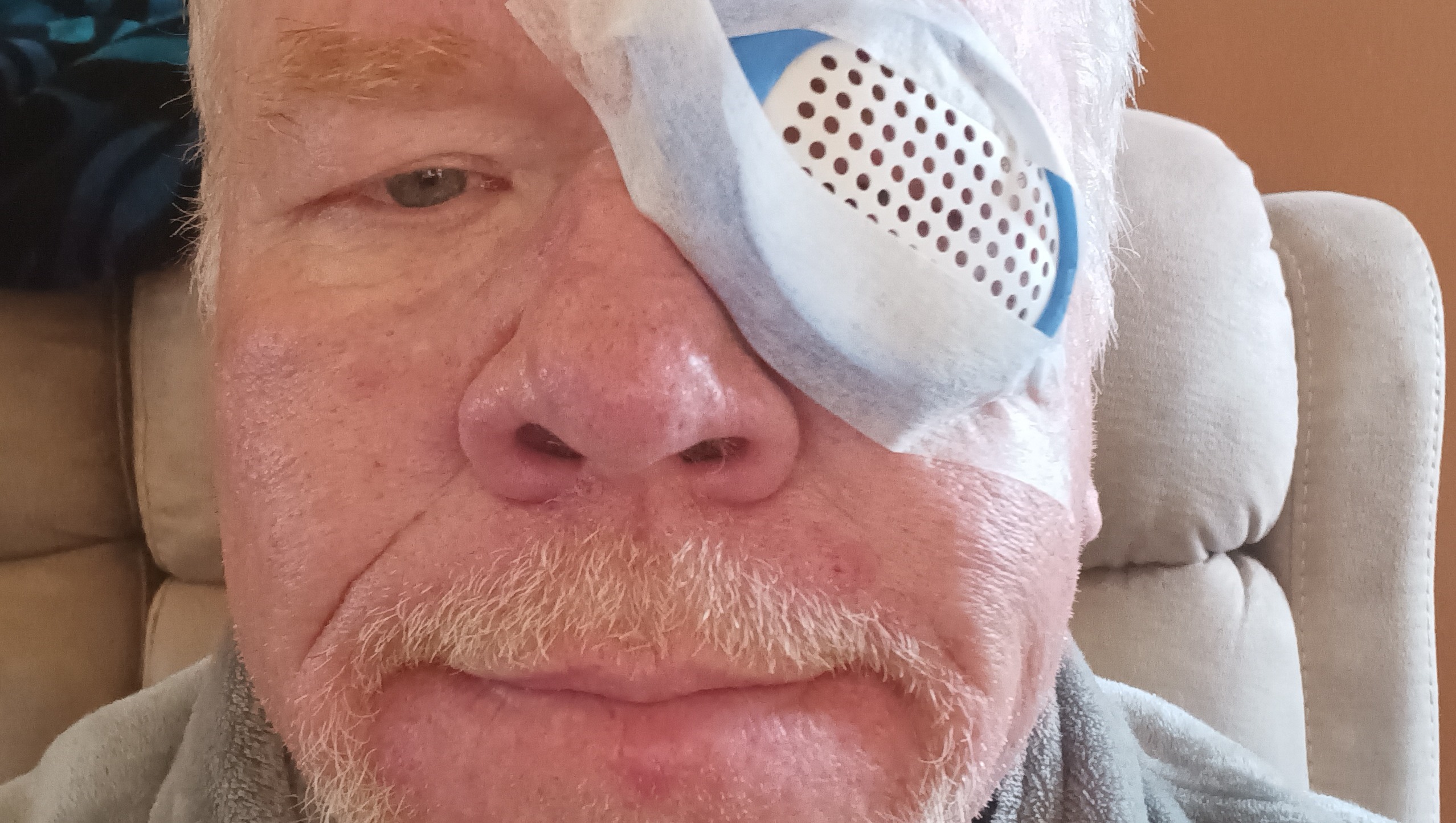 Fundraiser by Barry Porter : My medical bills for eye surgery