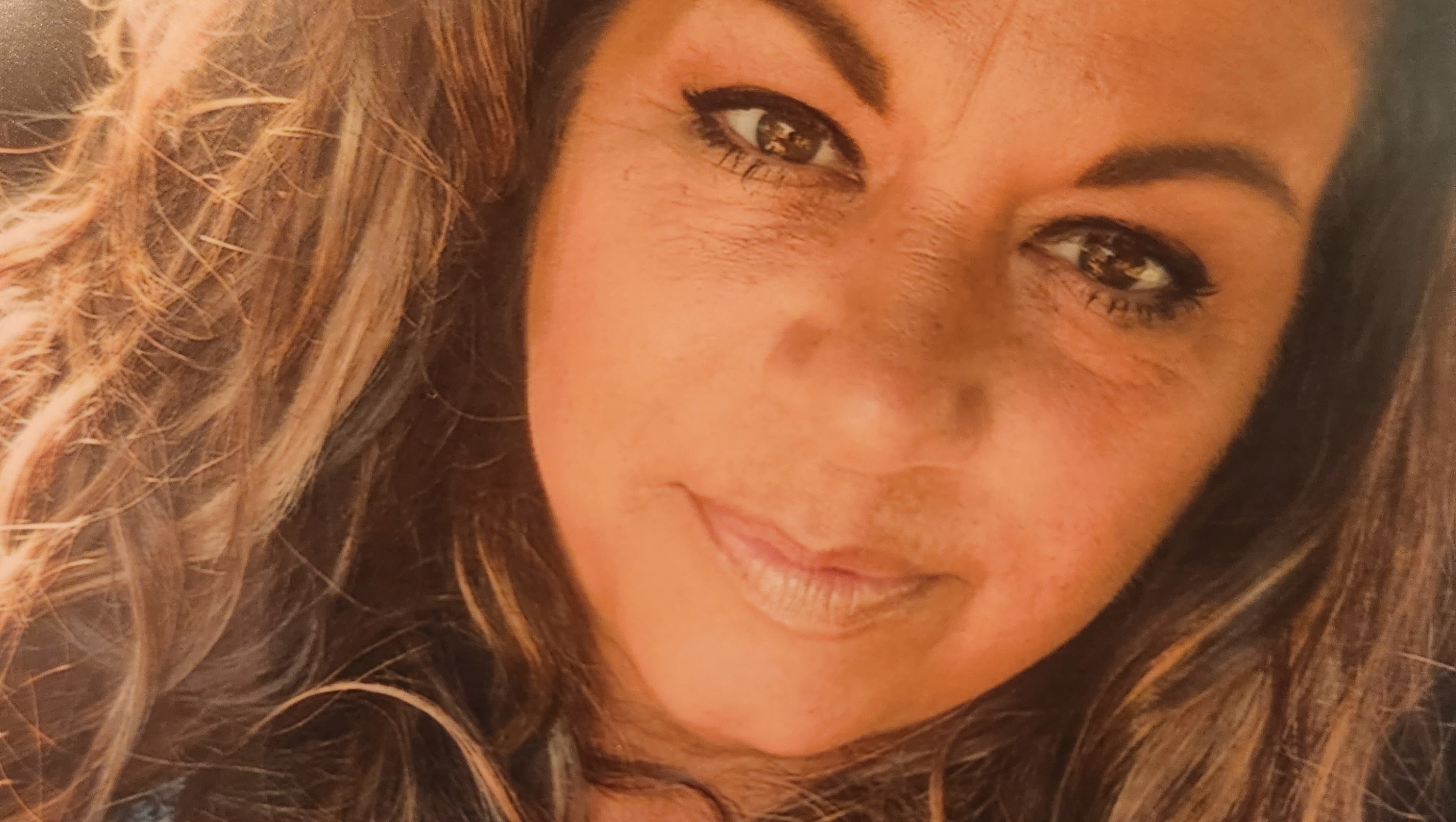 Fundraiser for Angie Rossi by Kim Rossi : Angie's Surgeries