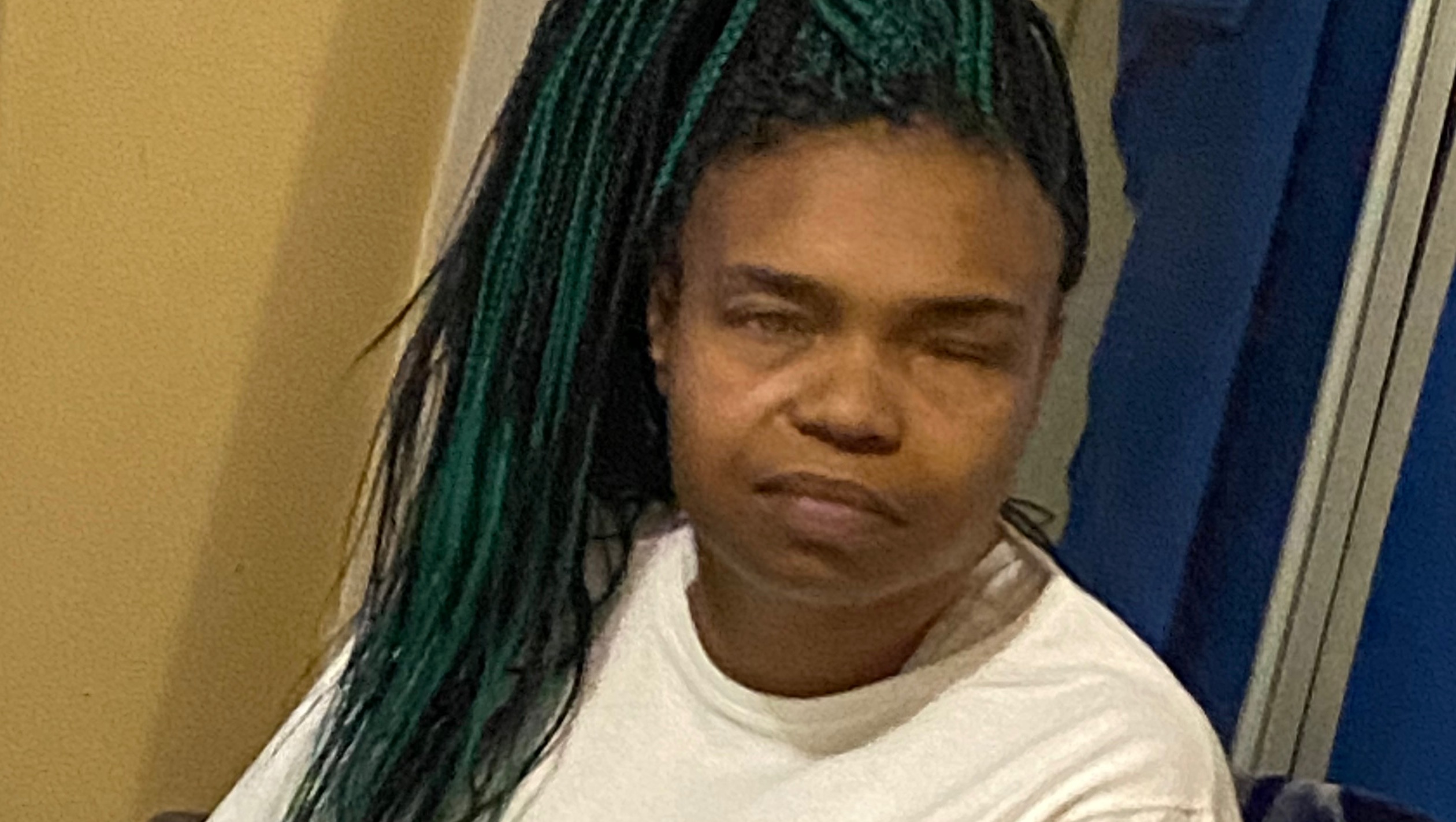 Fundraiser by Connie Lipford : Help me get my acrylic eyes