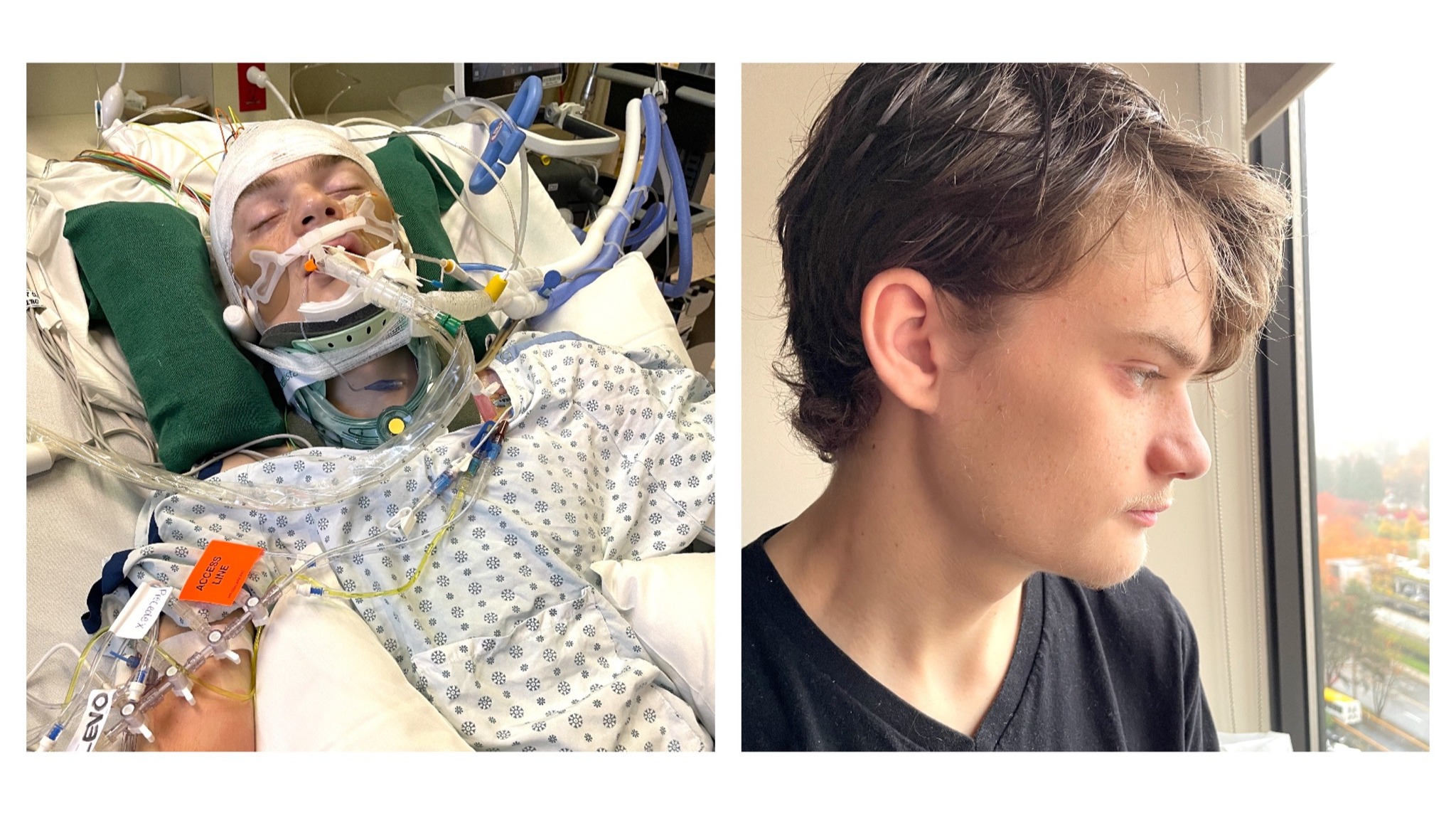 Fundraiser for Hayley Stovin by Alex Loraas : Help Sebastian recover ...