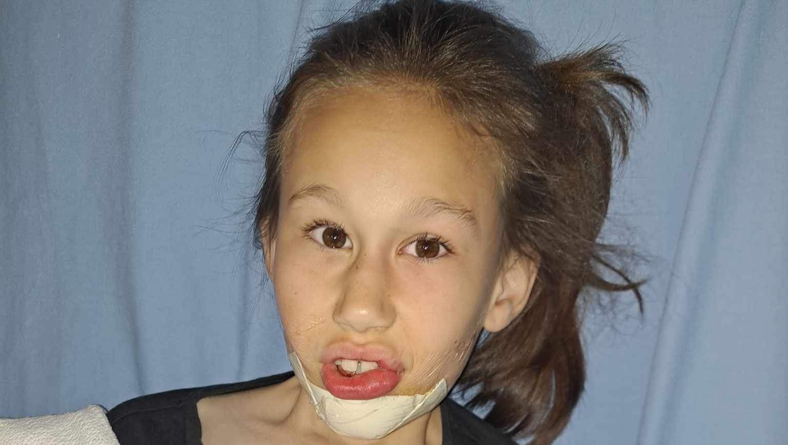 Fundraiser for Amanda Chisholme by Stephanie Hawke : Taleisha fighting ...