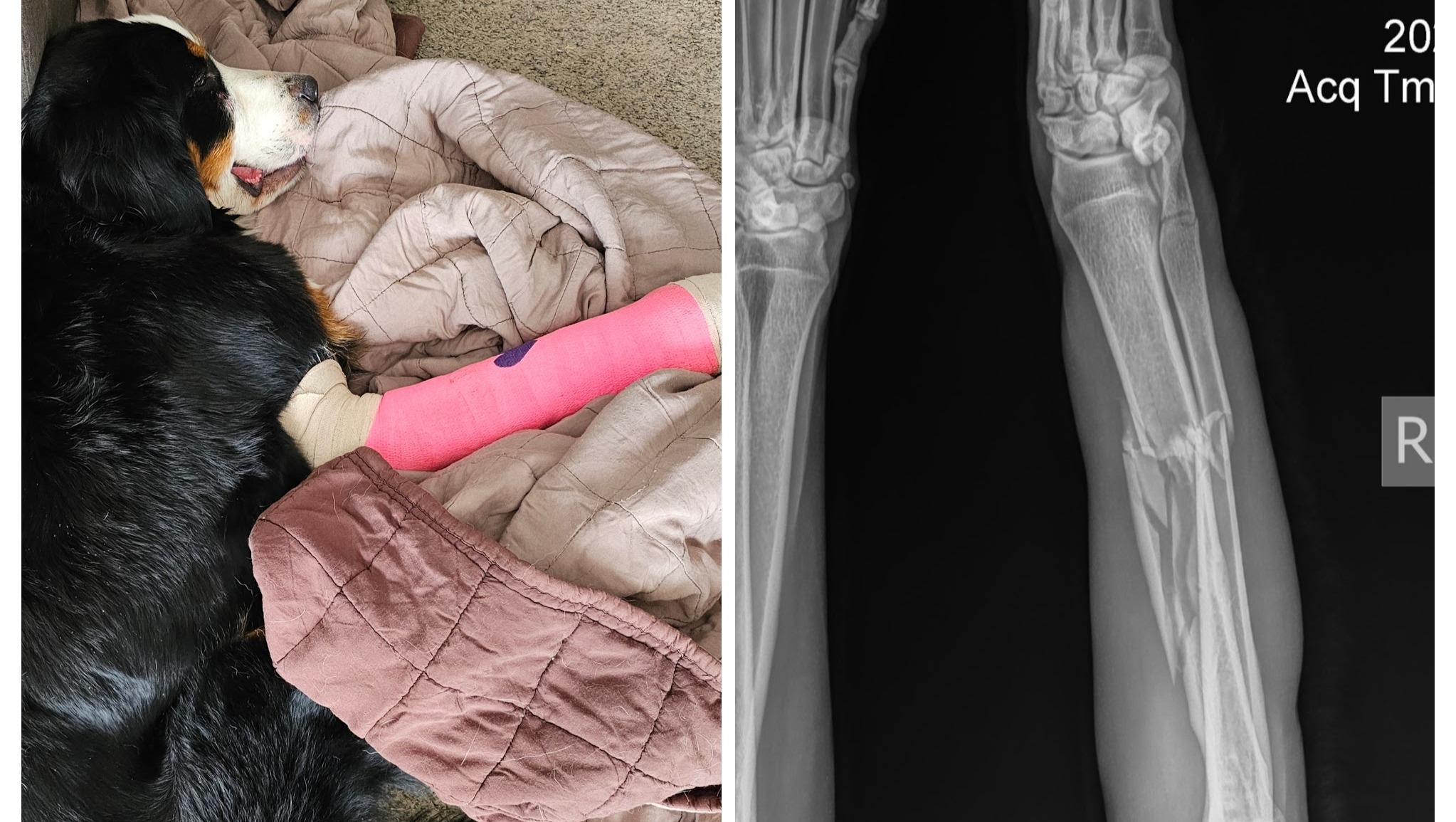 Fundraiser for ROBYNNE SIMONS-SEALY by Lorena Billig : Donate to Nova's ...