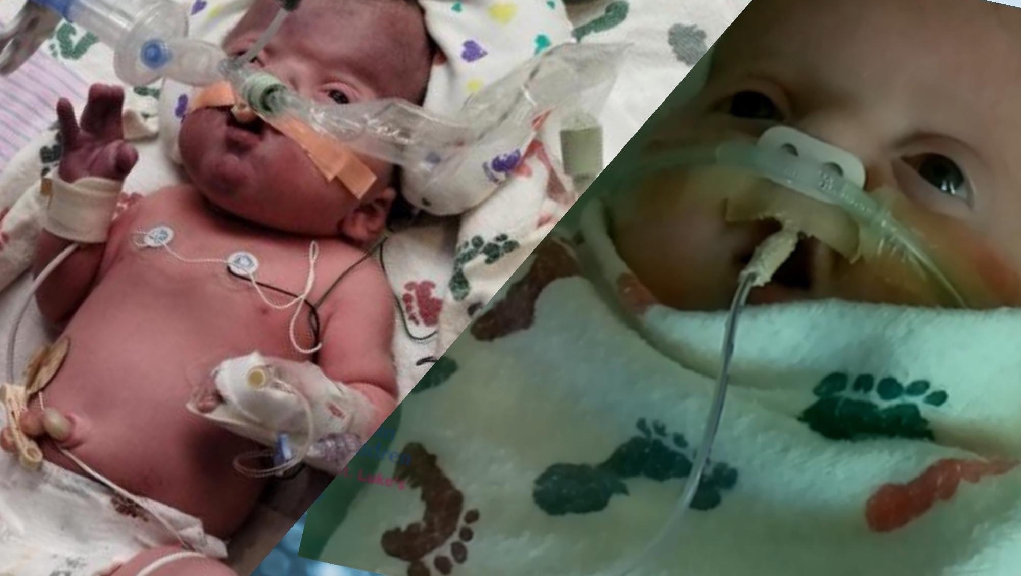 Fundraiser for Chris Chase by Jacki Jackson : Support for baby Eliyah