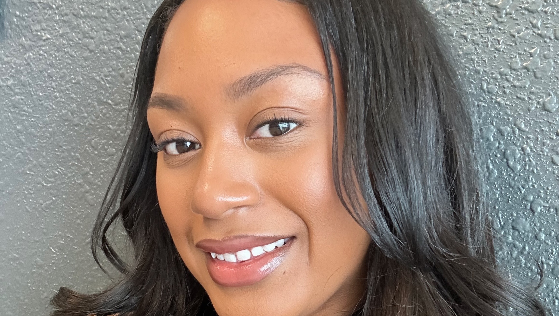 Fundraiser by Monaia Stephens : Monaia’s Facial Reconstructive Surgery ...