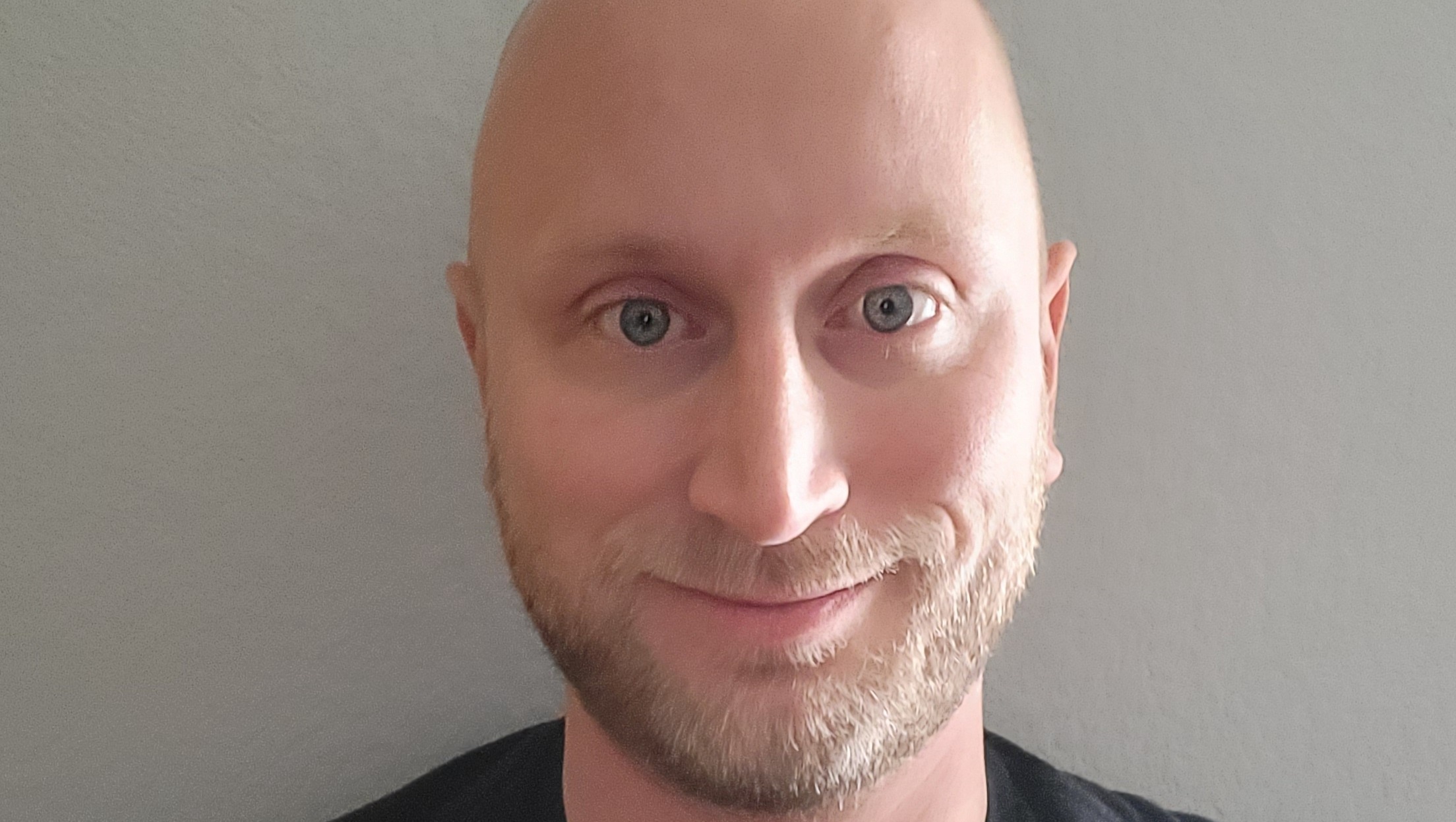 Fundraiser by Mike Milewski : Help Michael (me) Beat Stage Two Kidney ...