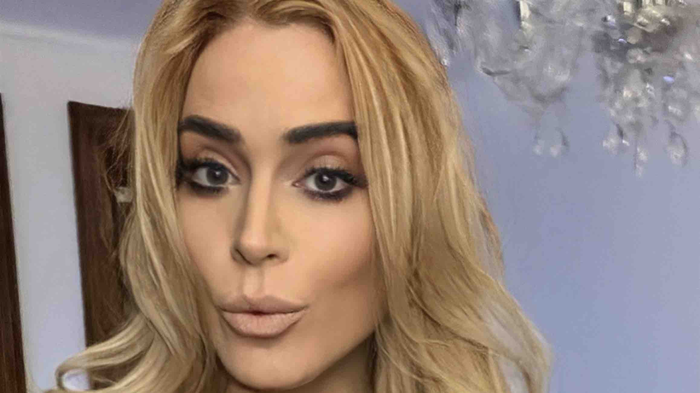 Fundraiser by Chloe Lapper : Help me raise for my FFS surgery