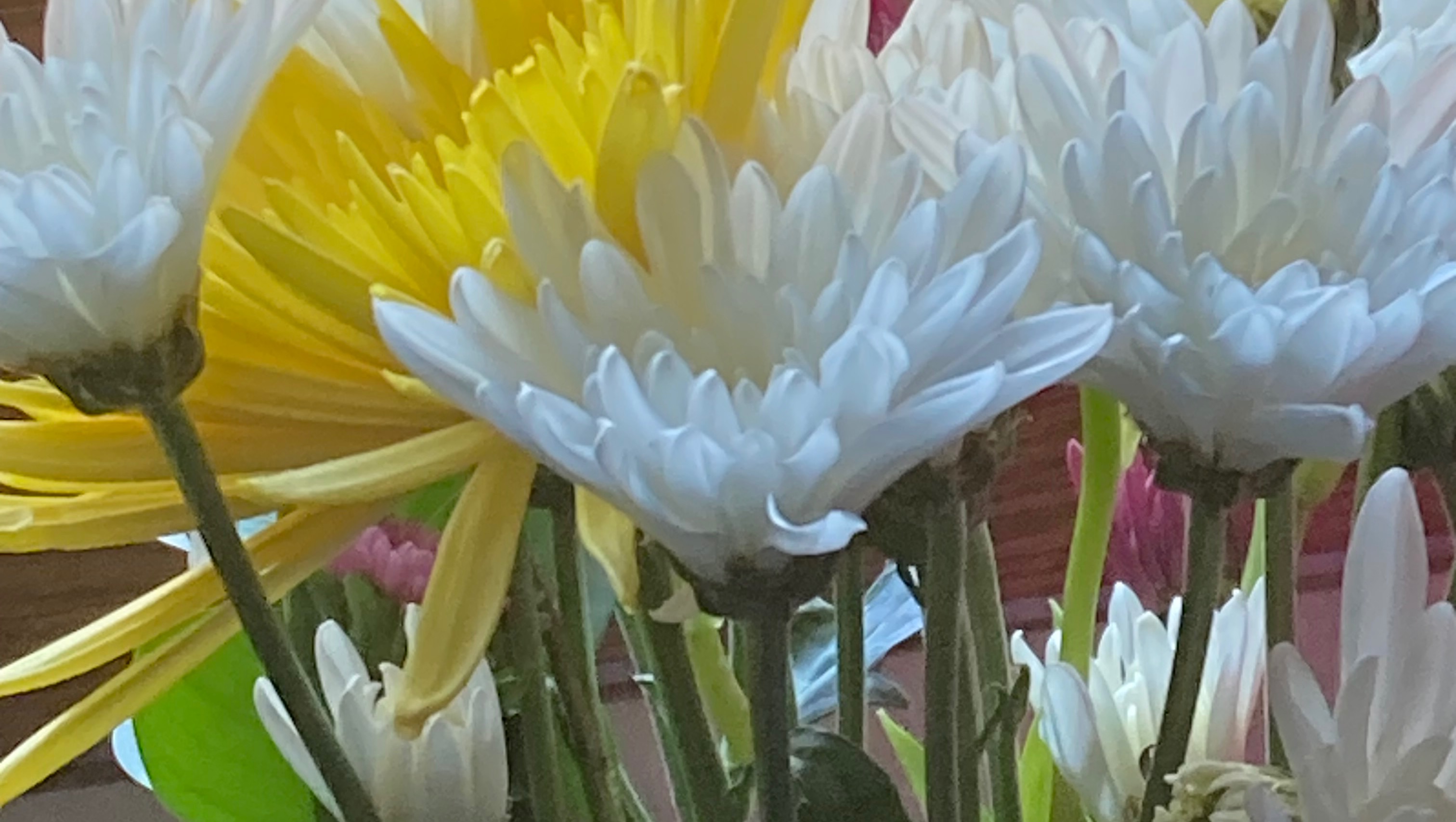 Fundraiser by Emily Spicer : Brain surgery aftercare