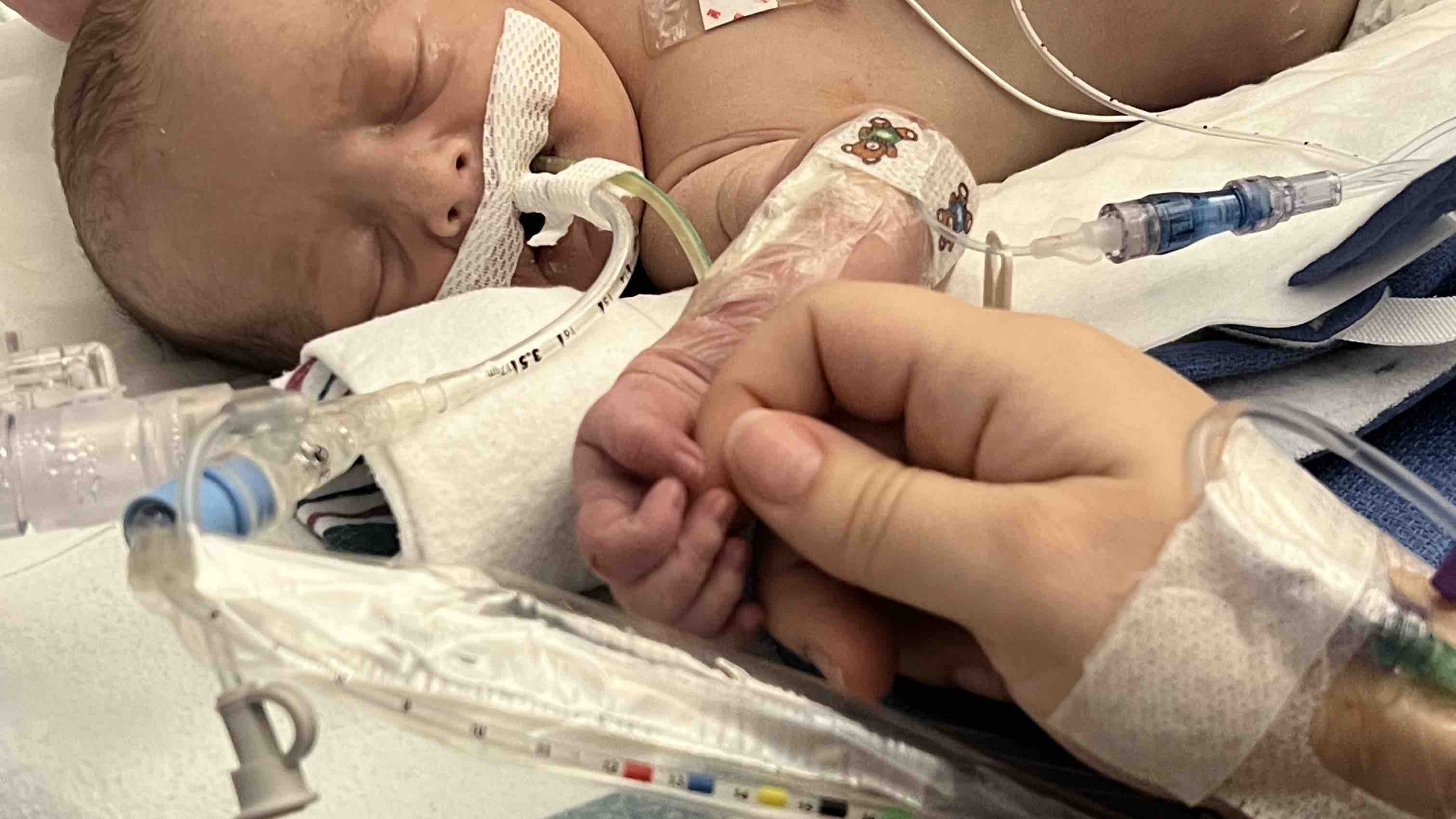 Fundraiser by Ginger Turner : Help Baby Myles medical expenses