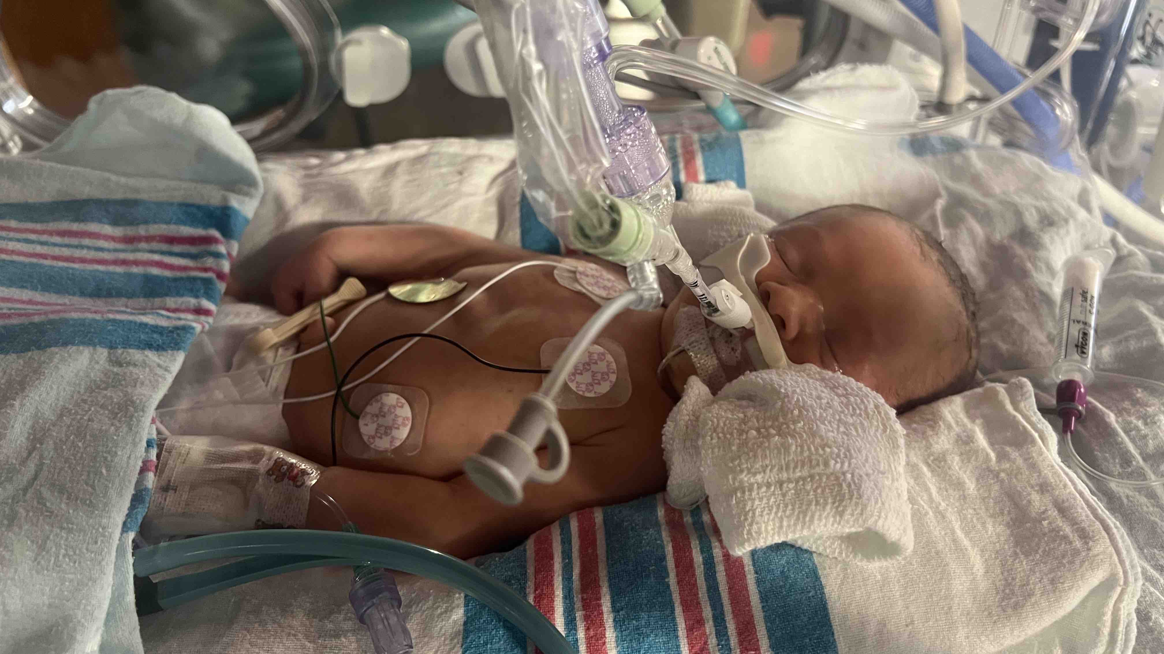 Fundraiser by Ben Lindsey : Help fund for baby Blakes troubles