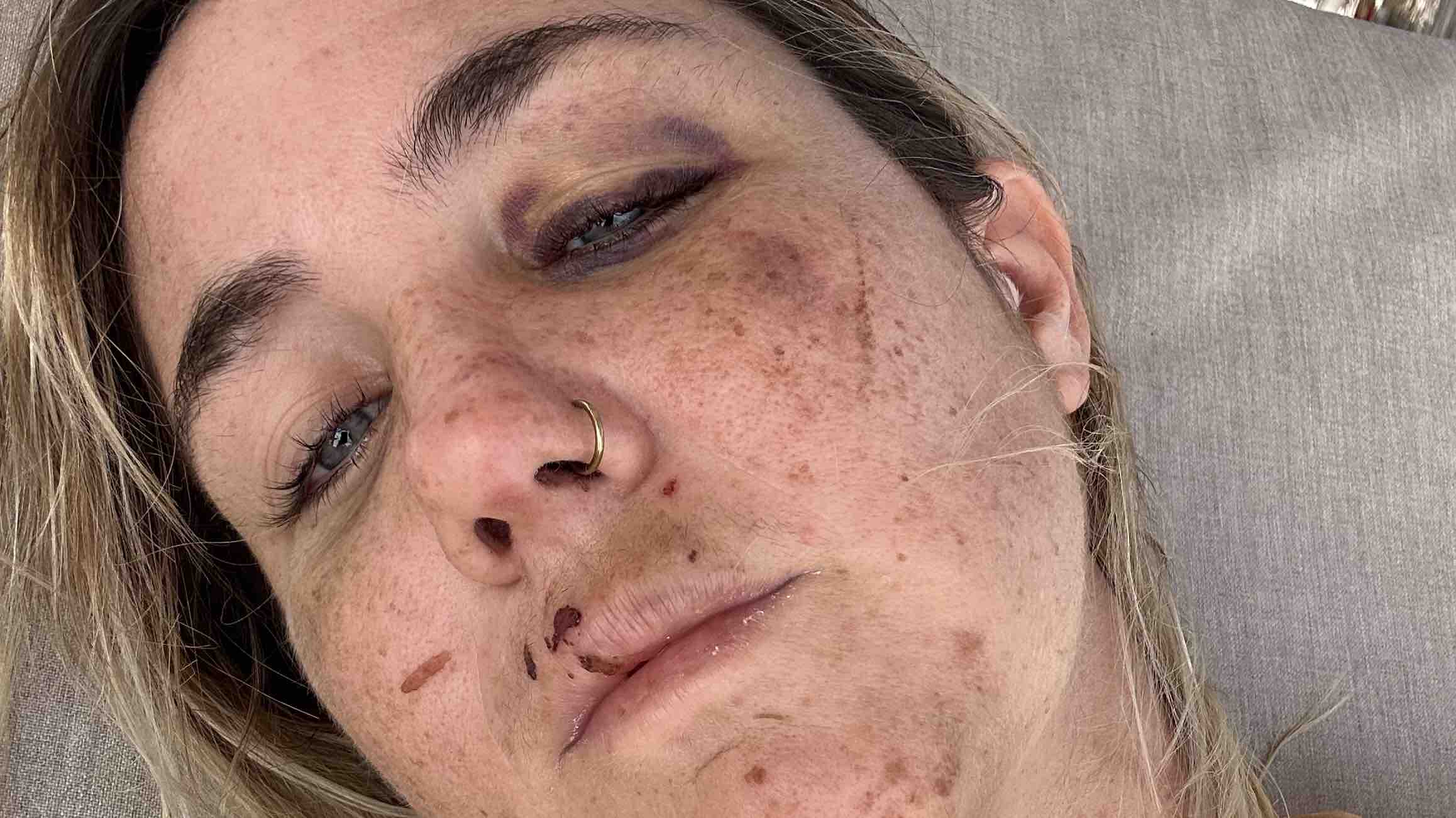 Fundraiser for Susan Berry by Giti Tehranchian : Help Sexual Assault ...