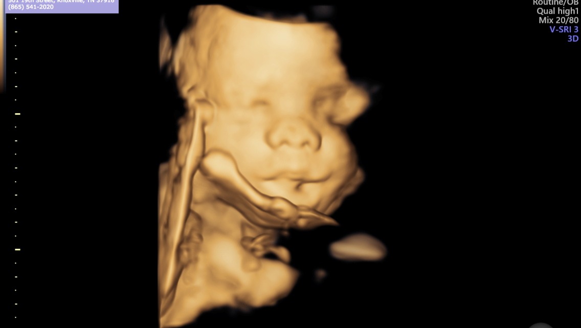 Fundraiser by Pangaea Norman : Kavadica Joyce Norman