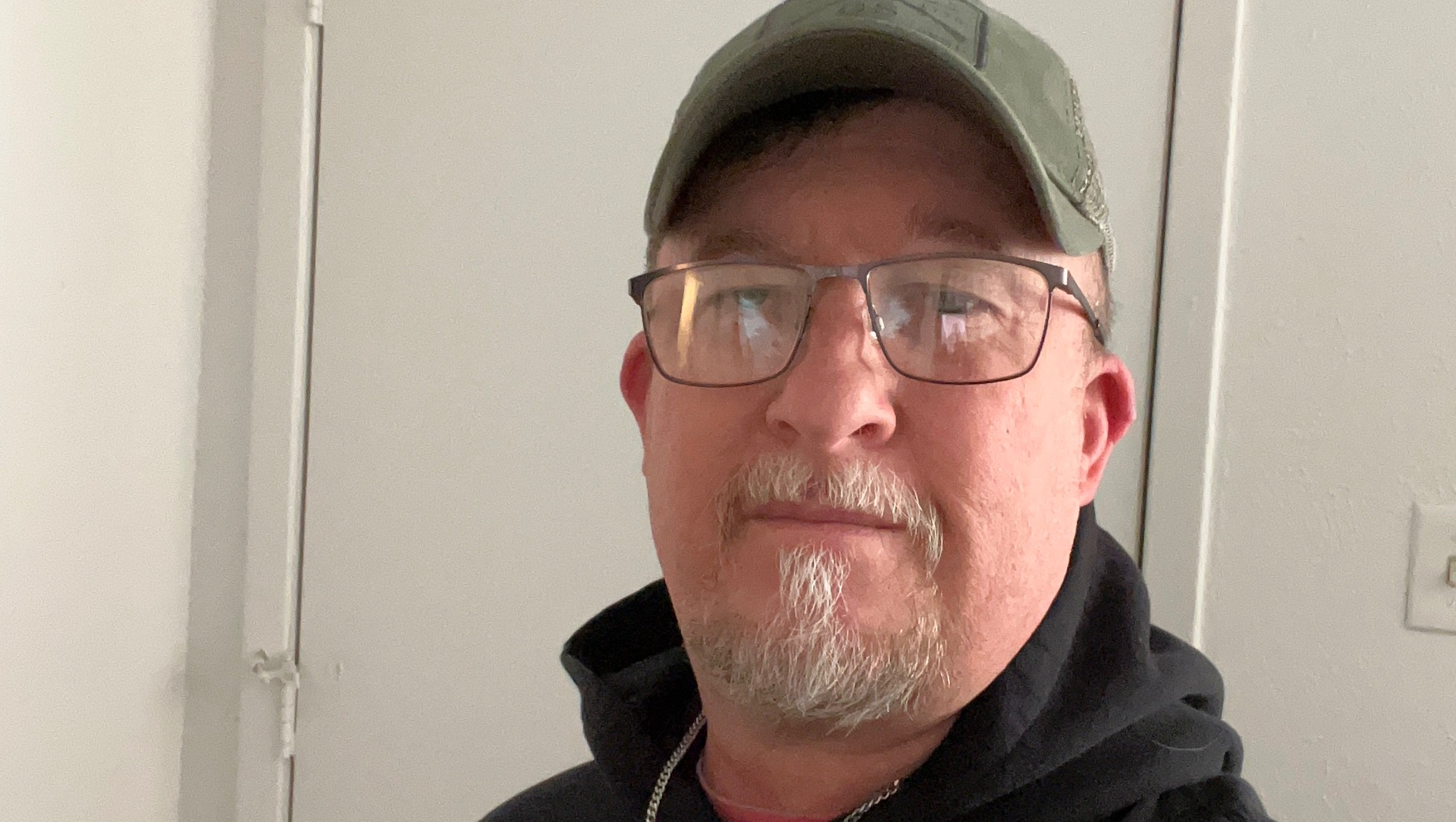 Fundraiser by troy trice : Basil cell carcinoma removal