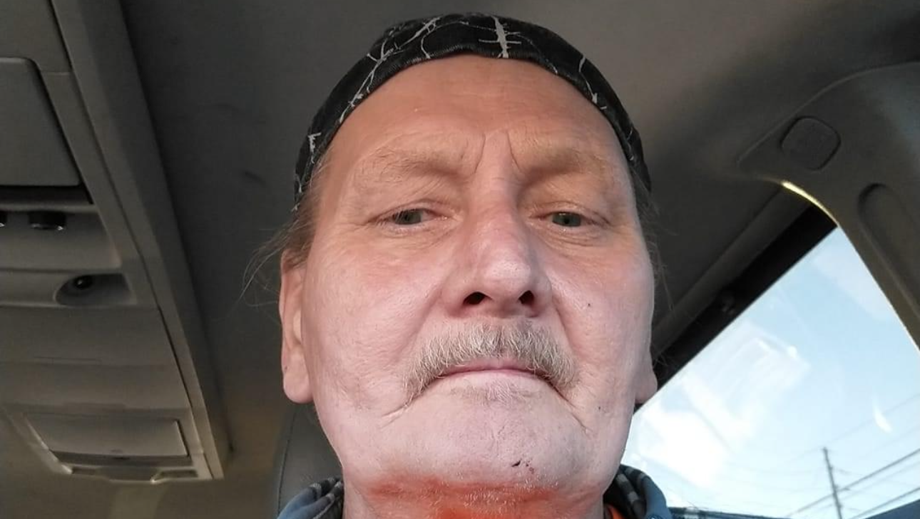 Fundraiser by Kyler Ferguson : Randy Ferguson