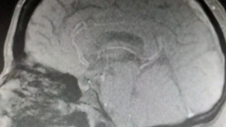 Fundraiser by Kristyn DeConti : Support Kristy as she has unexpected ...