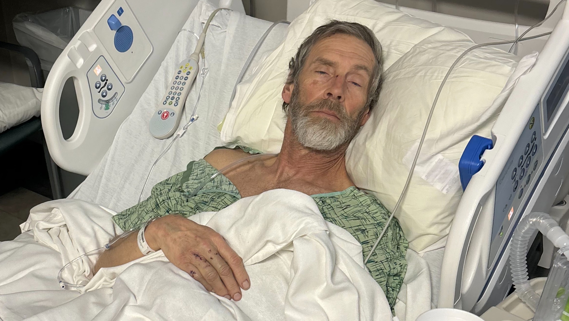 Fundraiser for James Wilson by Sarah Wilson : Help Jim Wilson On The ...