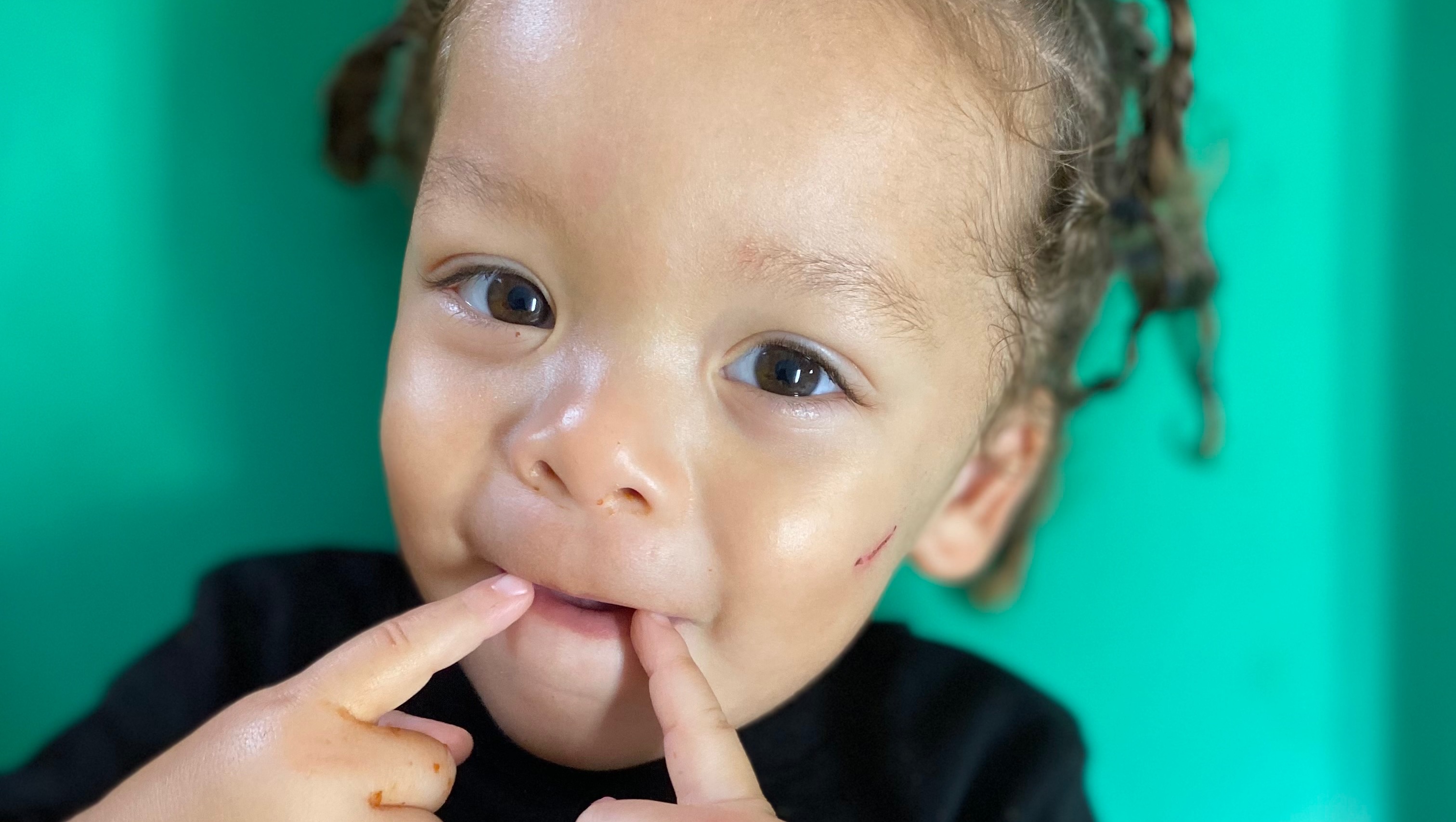 Spendenaktion von Amber Coy: Medical Expenses