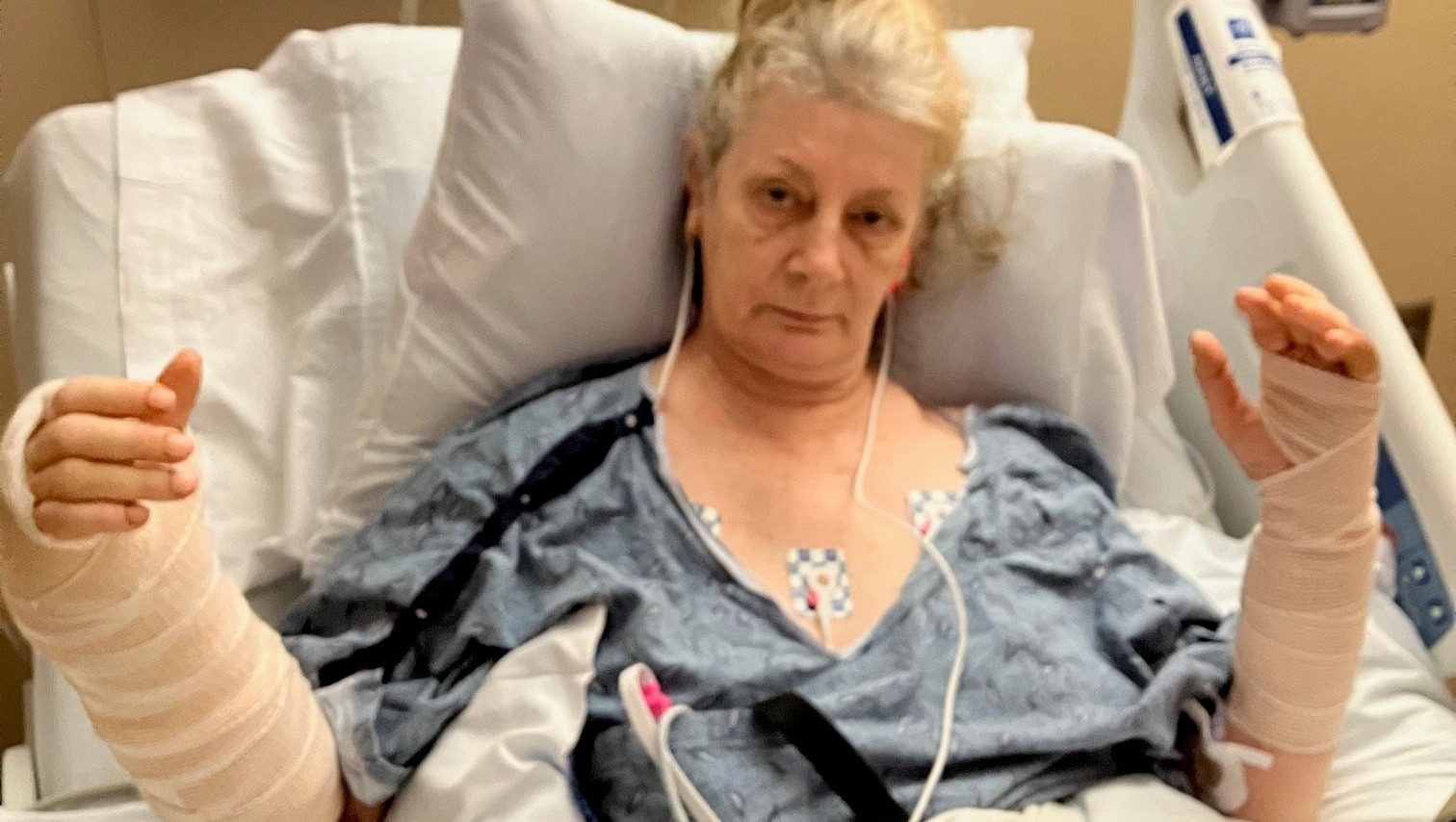 Fundraiser by Teresa Gleason : Updates For Robin