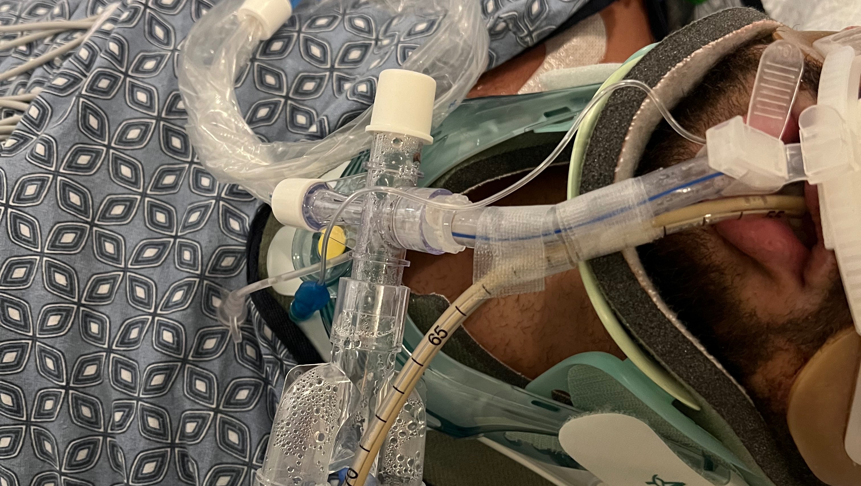 Fundraiser for Chad Dargis by Jazzmyn Andrade : Medical expenses ...