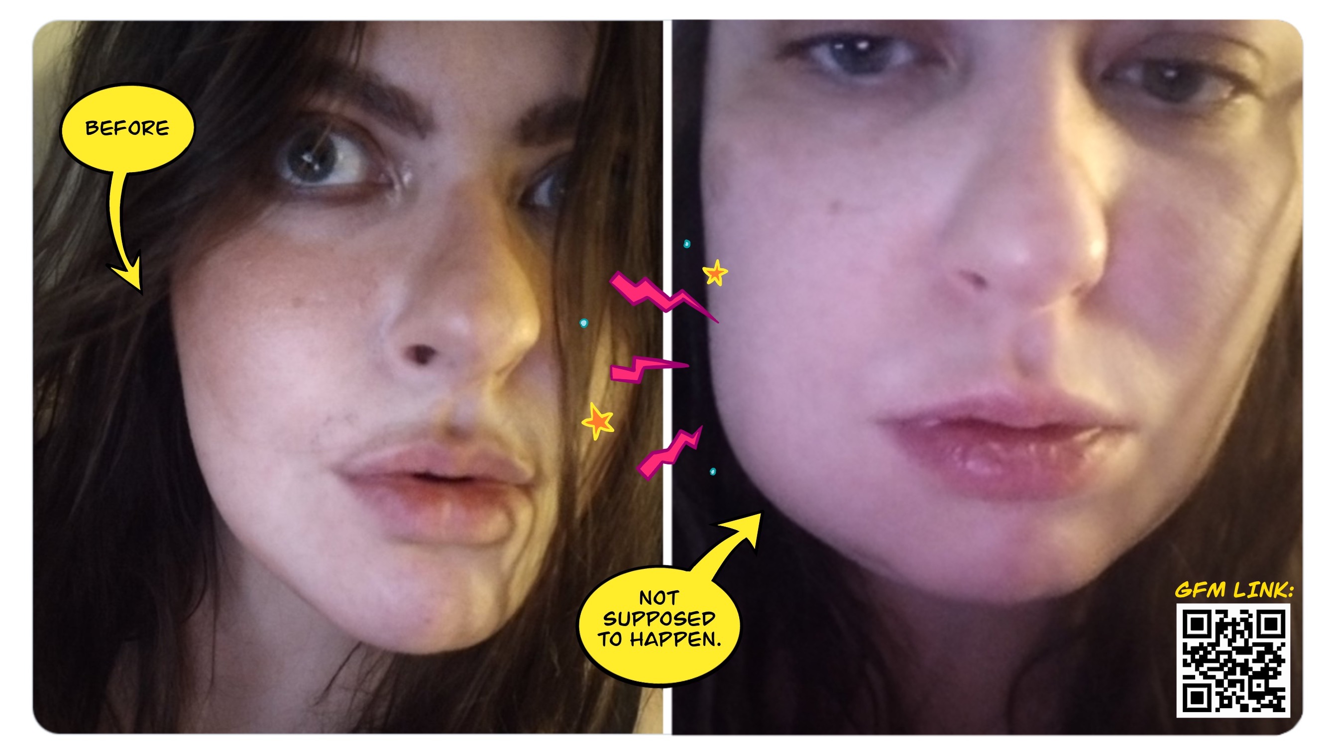 Fundraiser by A. Stiffler : Help Fix K's Exploding Face (Dental Emergency)