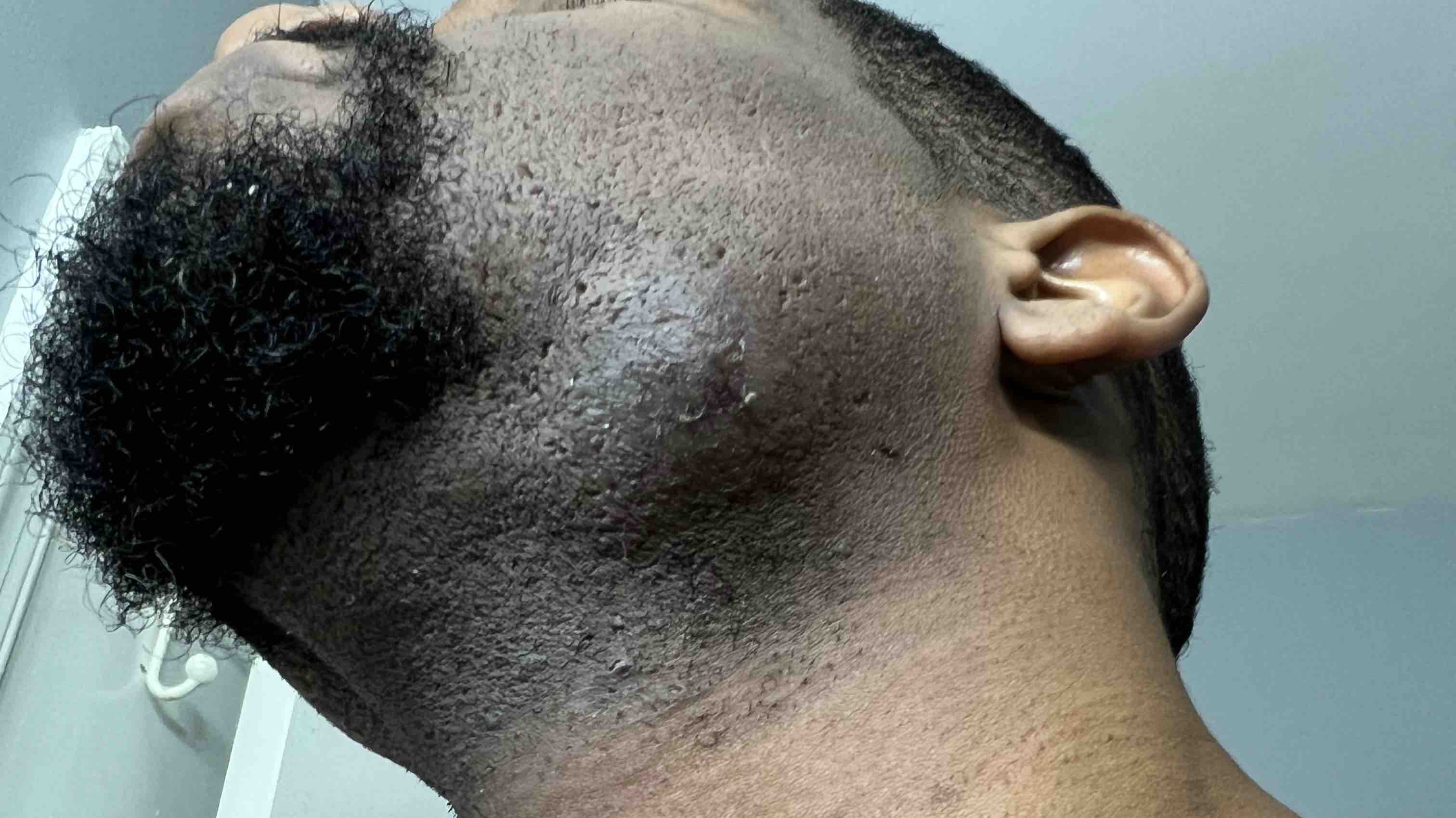 Fundraiser by Marcus Dickerson : Medical Emergency In The Way Of ...
